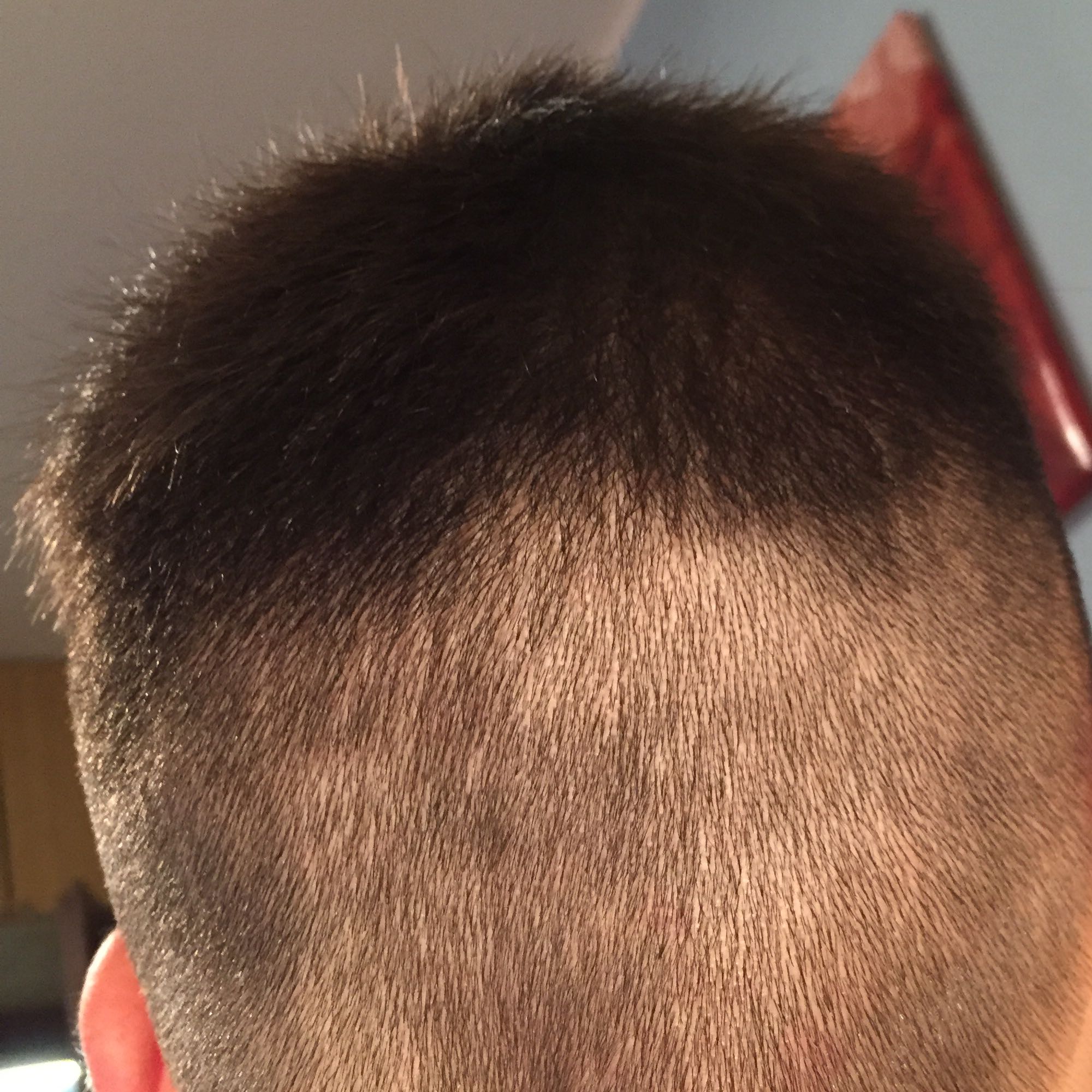 HILFE! Mein Friseur hat meine Harre verunstaltet, was soll ich machen ...