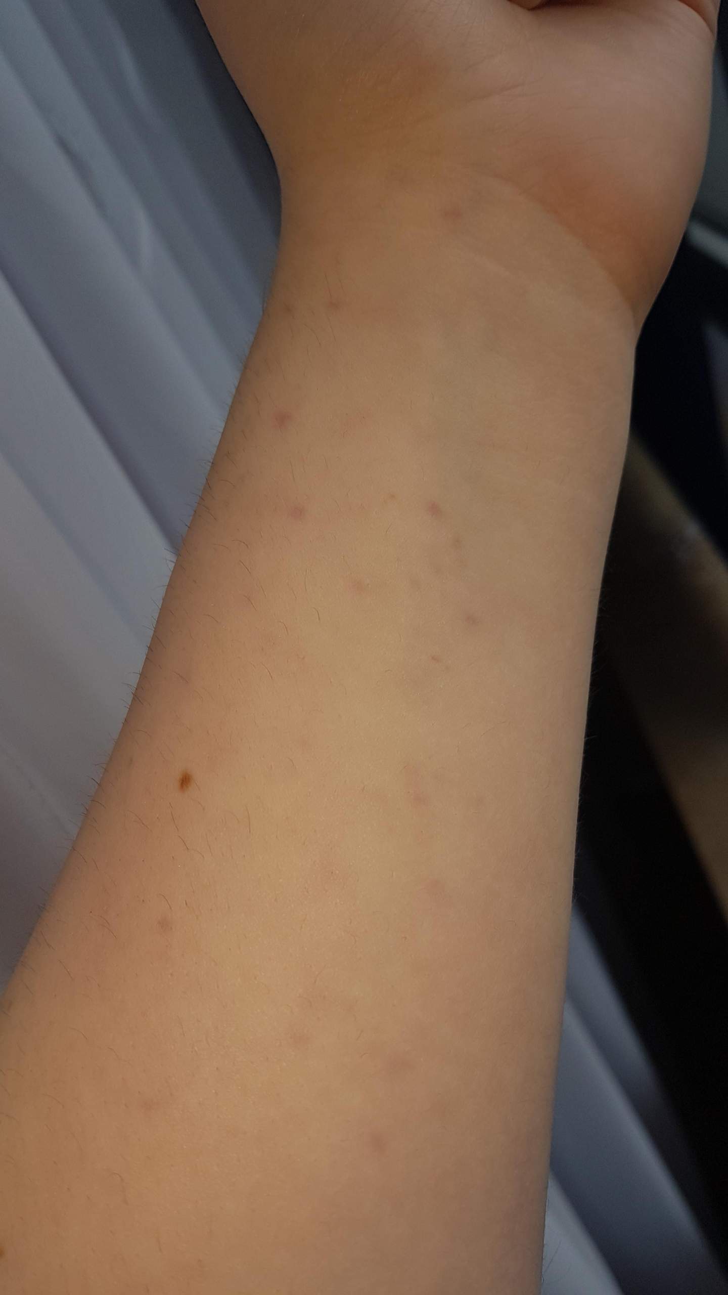 Ich hab komische Punkte am Unterarm? (Gesundheit, Haut)