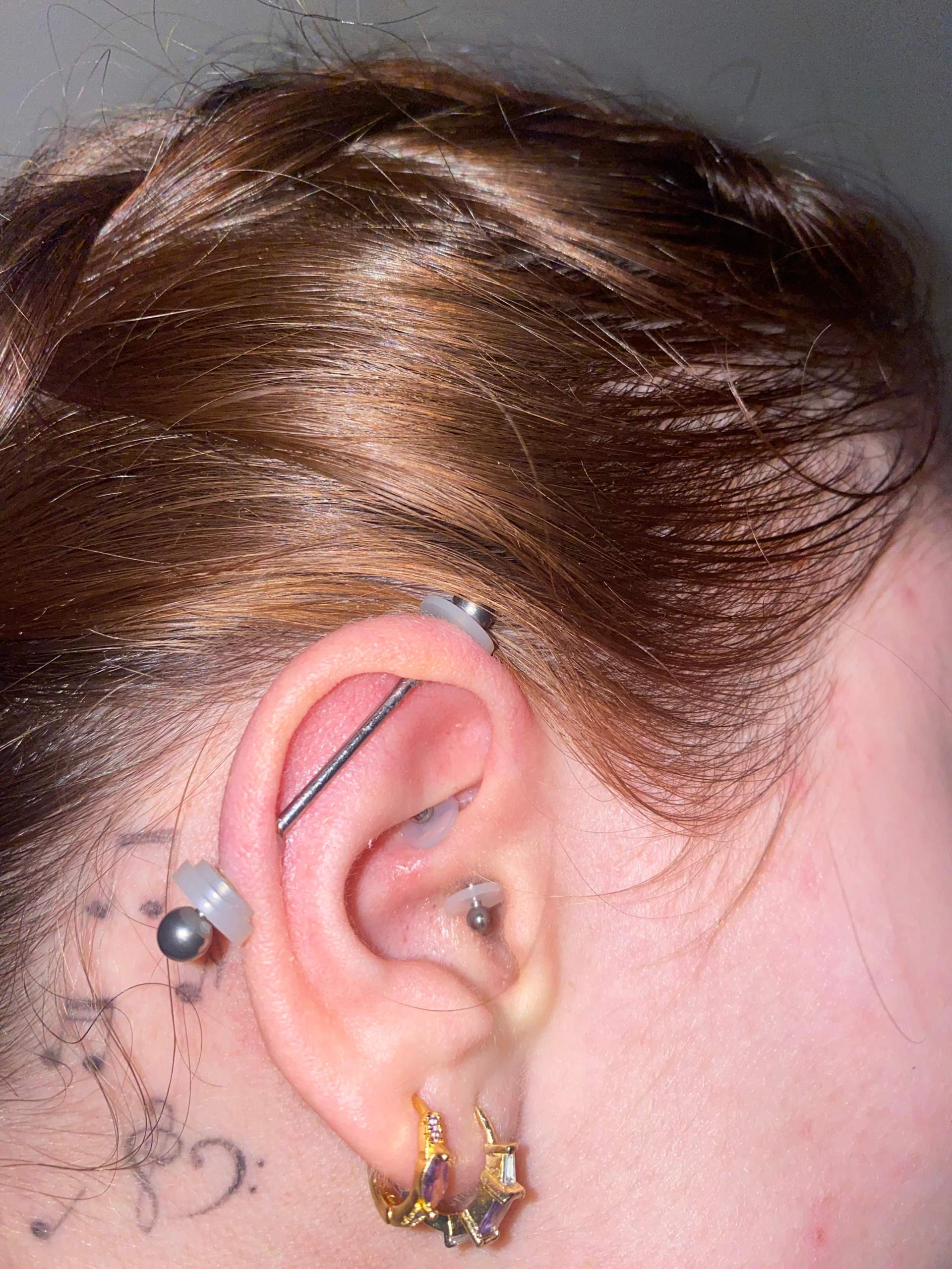 industrial&daith wildfleisch? (Piercing, Entzündung, Ohr)