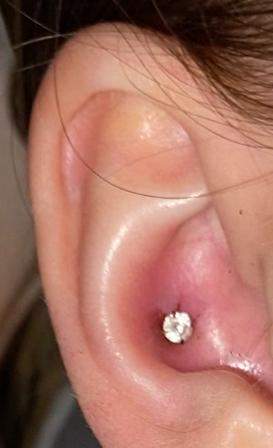 Inner Conch jetzt schon entzündet? (Piercing, Entzündung, Piercingstudio)