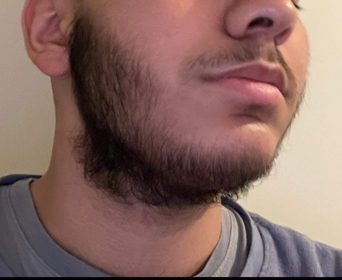 Ist das ein Bart? (Männer, Aussehen, Bartwuchs)