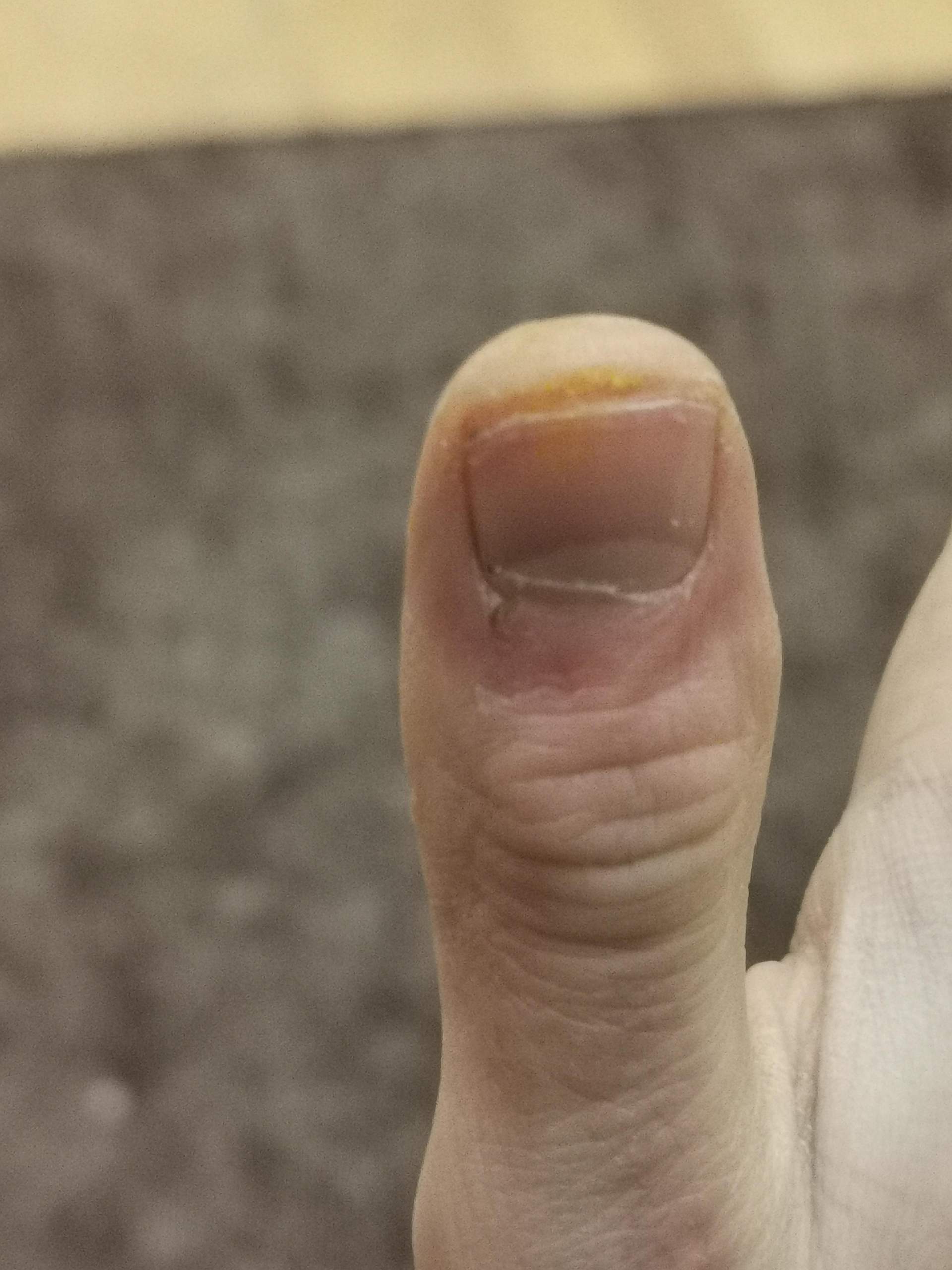 Ist es eklig wenn man immer gelbe Nägel hat? (Kalorien, Getränke, Hygiene)