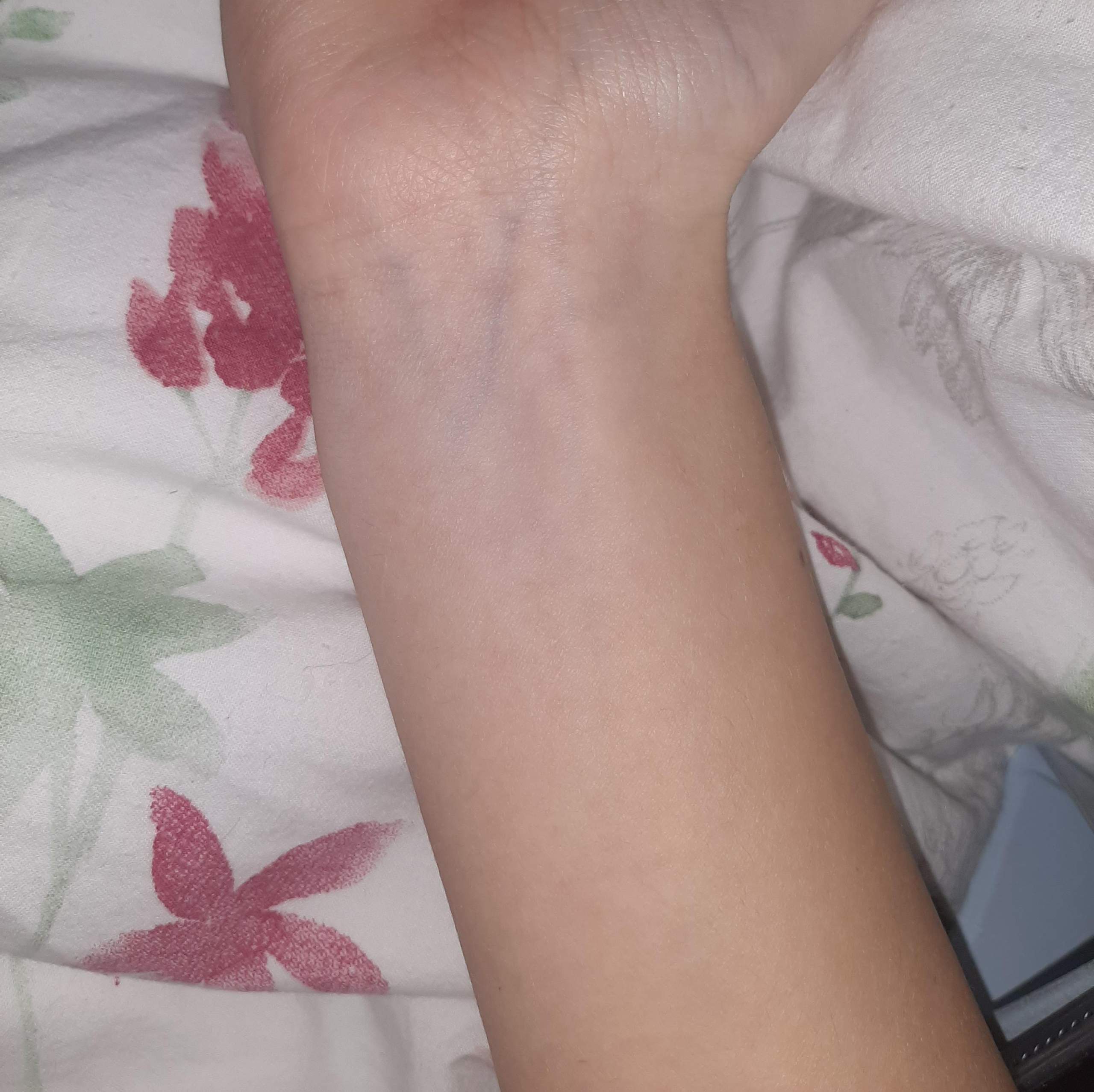 ISt es normal das bei mir die Adern am linken Arm so blau sind ...