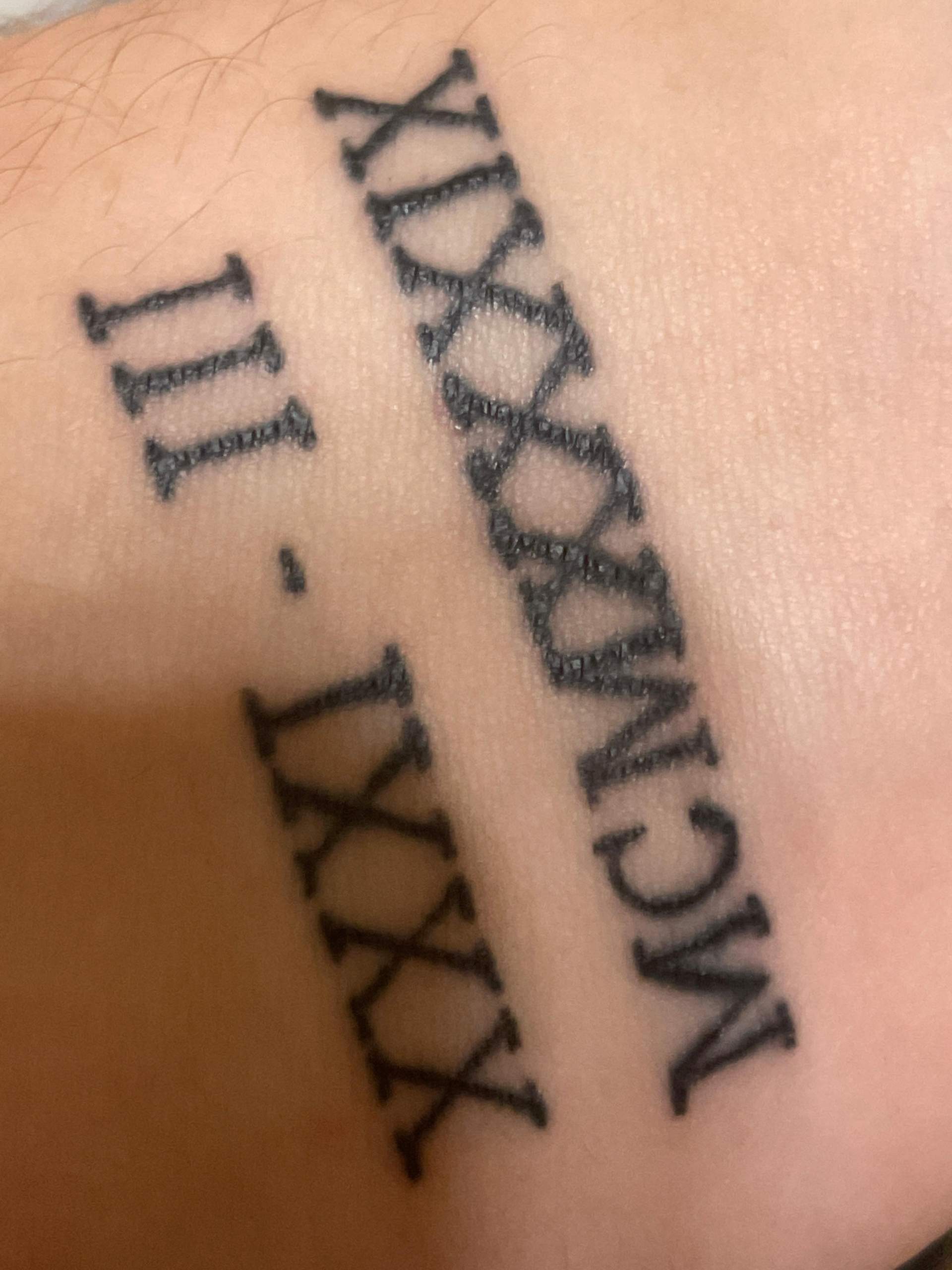 Ist Es Normal Das Man Mein Tattoo F llen Kann Haut Bodymodification ist-es-normal-das-man-mein-tattoo-f-llen-kann-haut-bodymodification