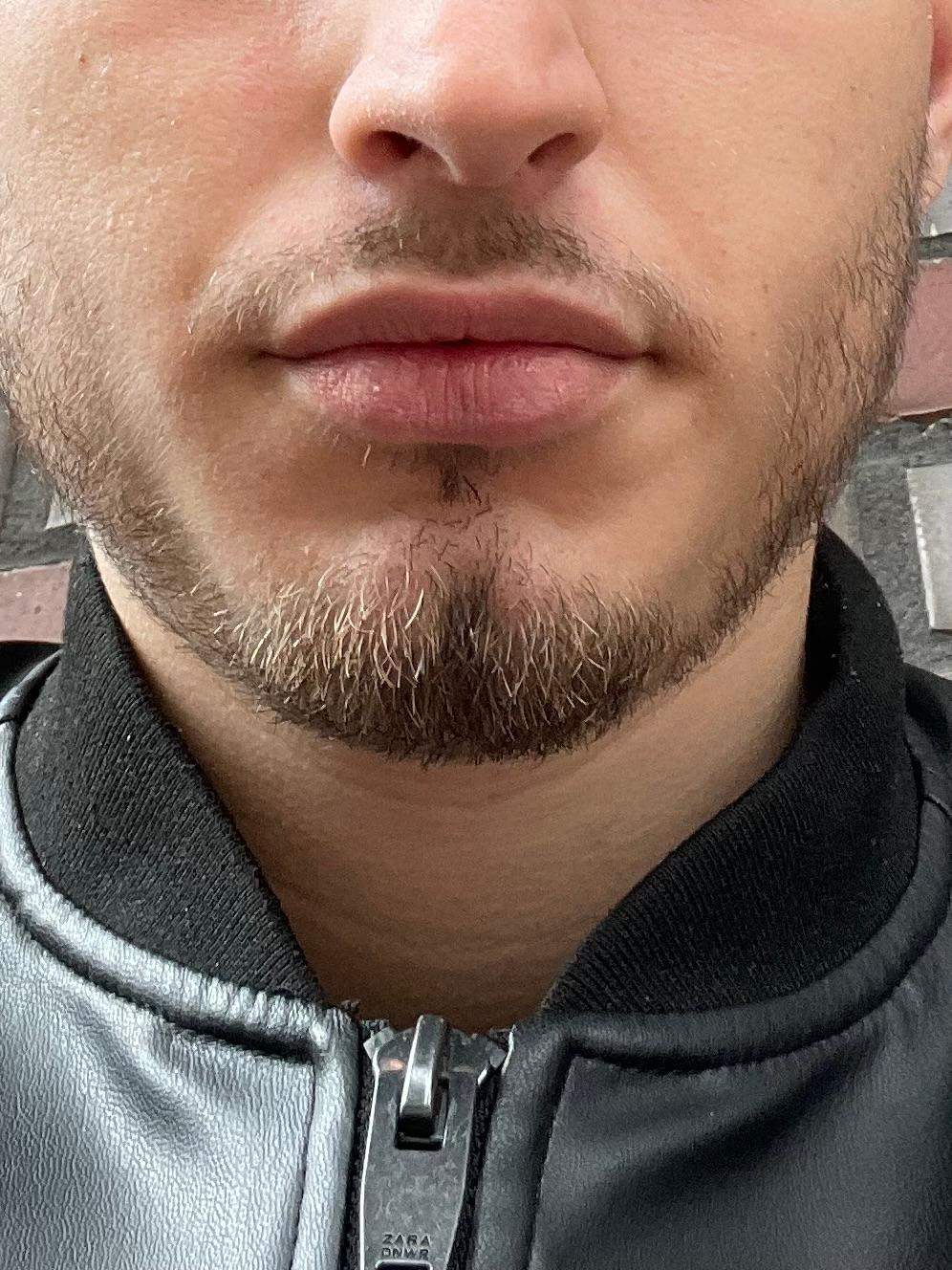 Ist mein Bart Weiß? (Haarfarbe, Haare färben, Bartwuchs)