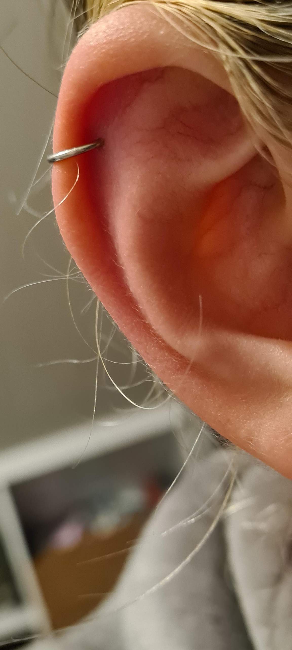 Ist mein Helix entzündet? (Schmerzen, Piercing, Entzündung)