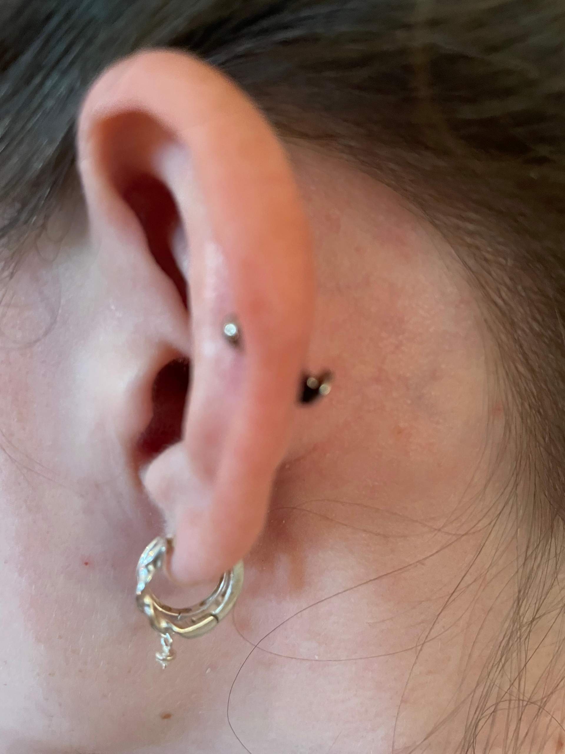 Ist mein Helix schief gestochen? (Piercing, Piercer, Ohrknorpelpiercing)