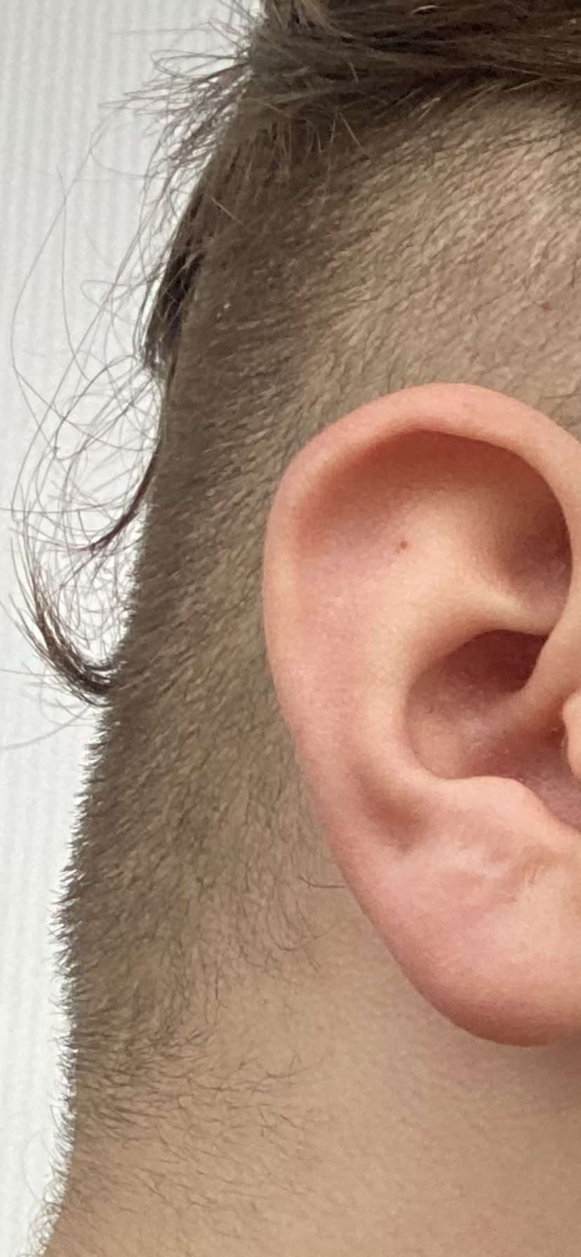 Ist mein Hinterkopf gerade? (Friseur, Kopfform)