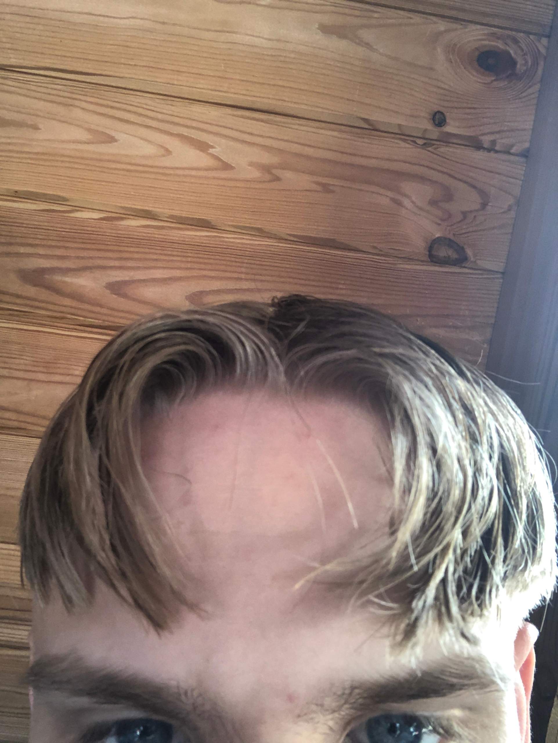 Ist meine Stirn zu groß für ein Mittelscheitel? (Männer, Style, Friseur)