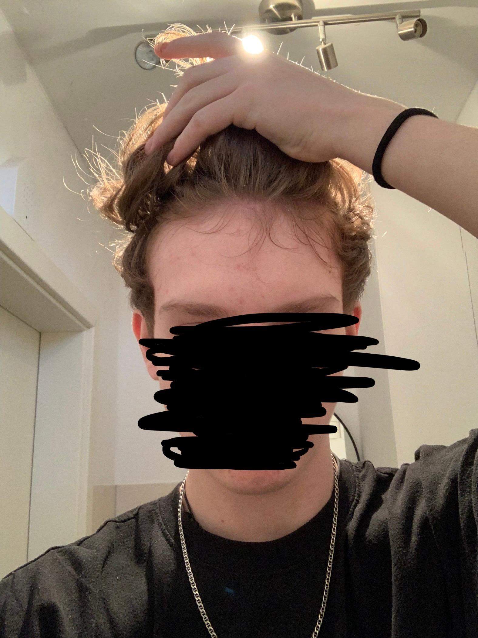 Ist meine stirn zu groß für einen Boxerschnitt? (Jungs, Männer, Aussehen)