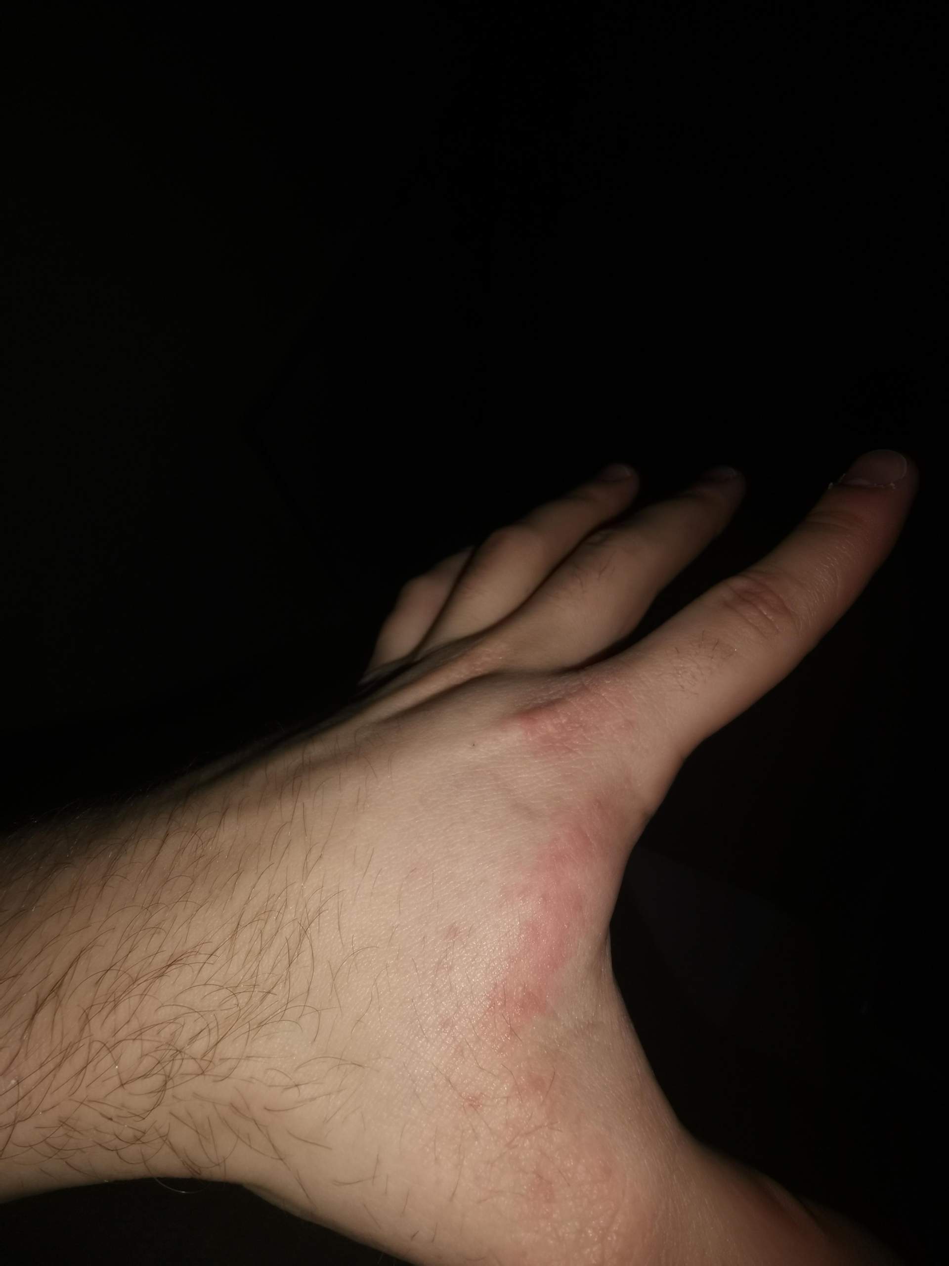 Juckende kleine Pusteln Auf der Haut? (Hautarzt, Hautprobleme)