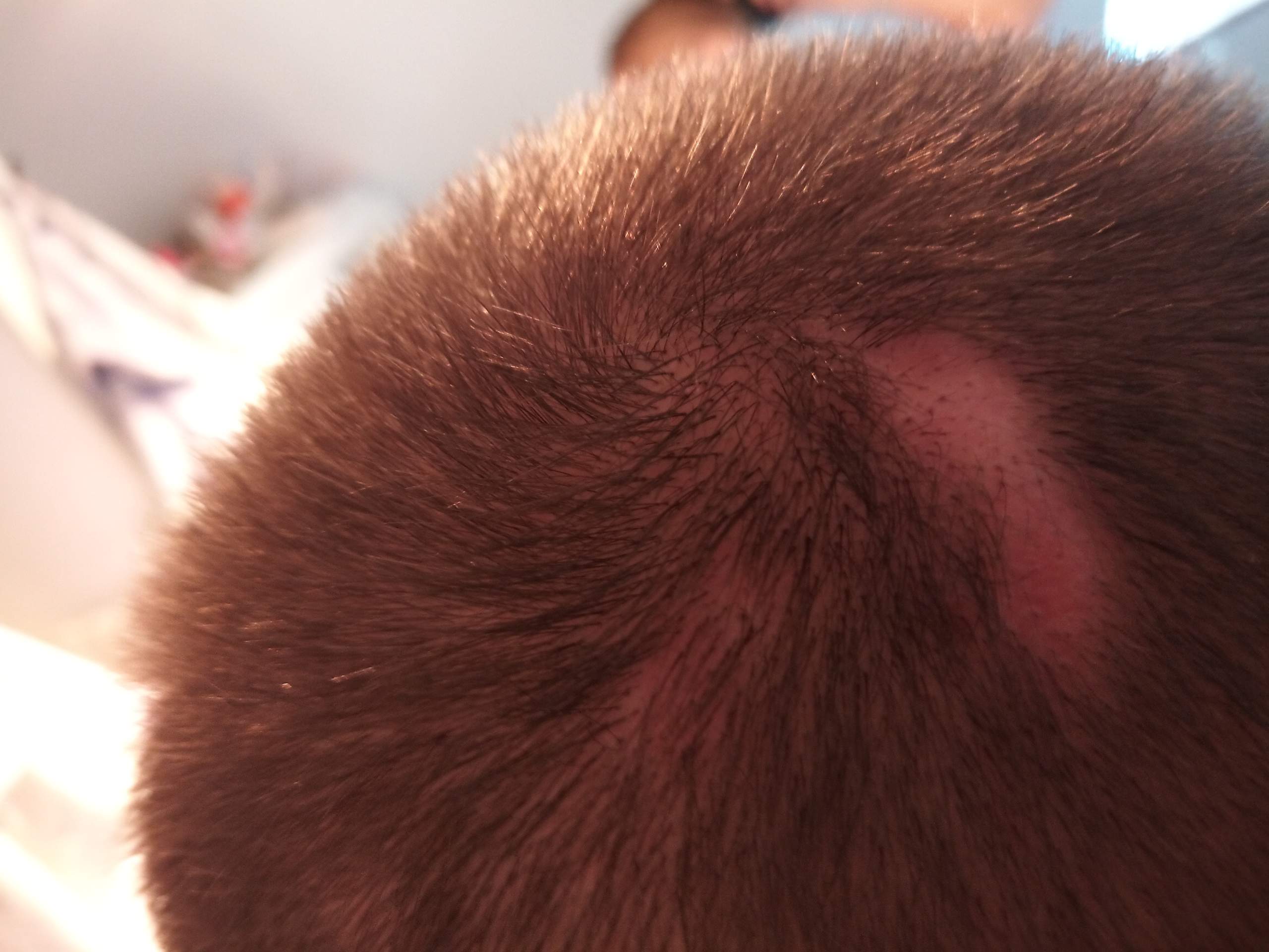 Kahle Stelle am Hinterkopf mit Haar Wurzeln? (Haare, Kopf)