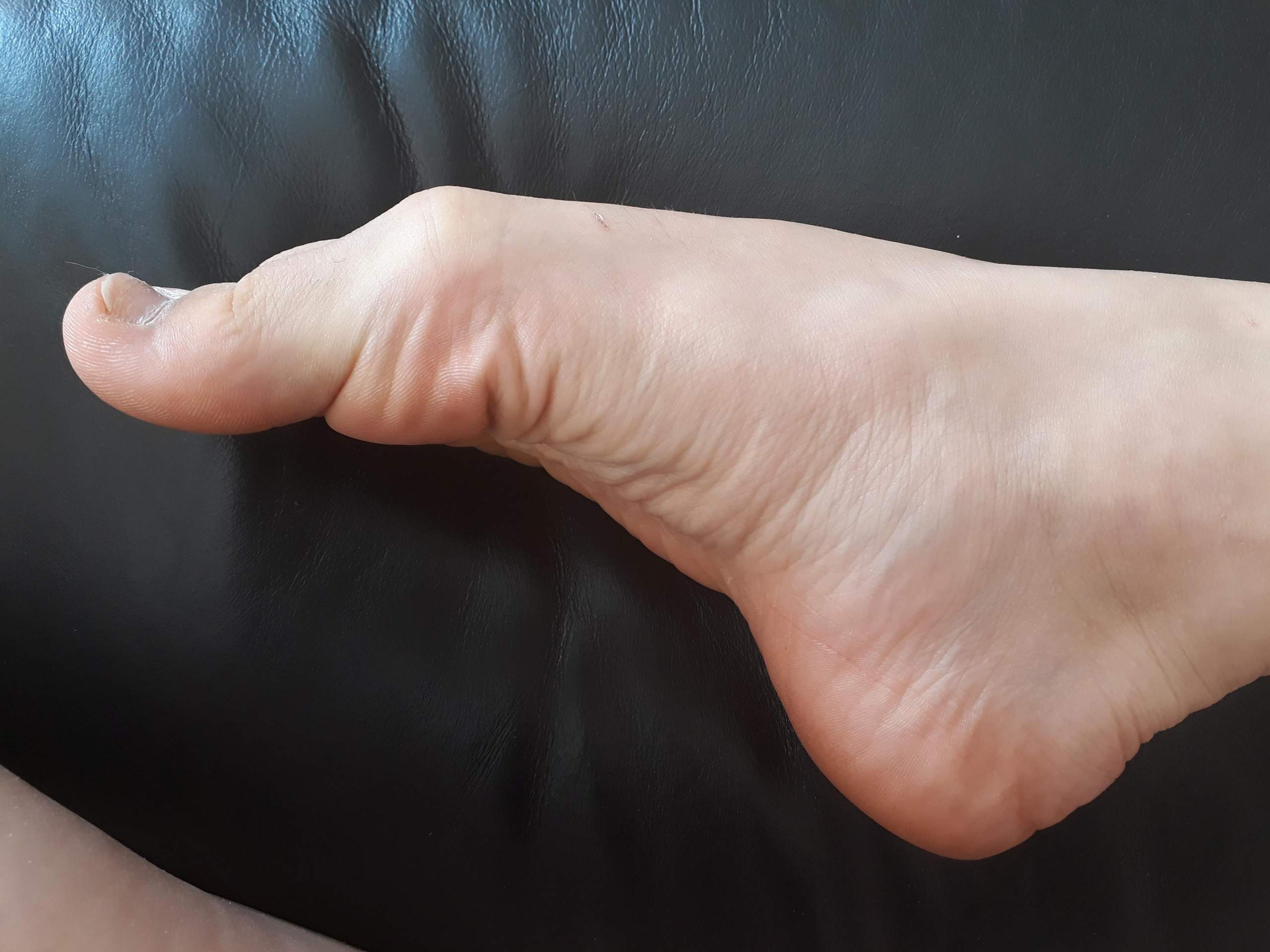 Kann ich mit diesem Fußspann beim Ballett auf die Spitze gehen ...