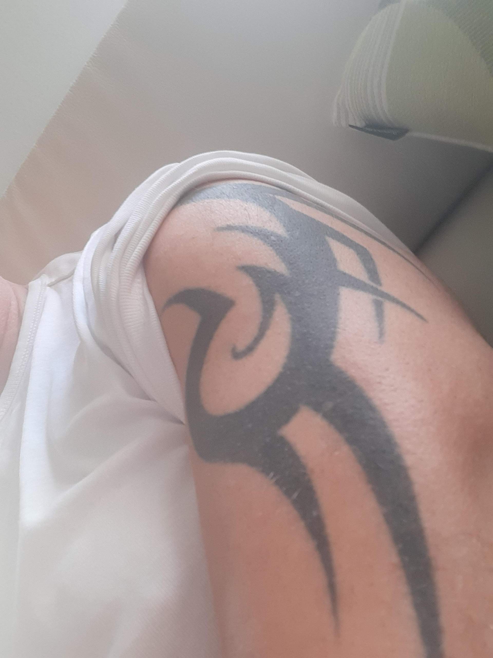 Kann man ein altes Tattoo/Tätowierung komplett entfernen/weg lasern ...