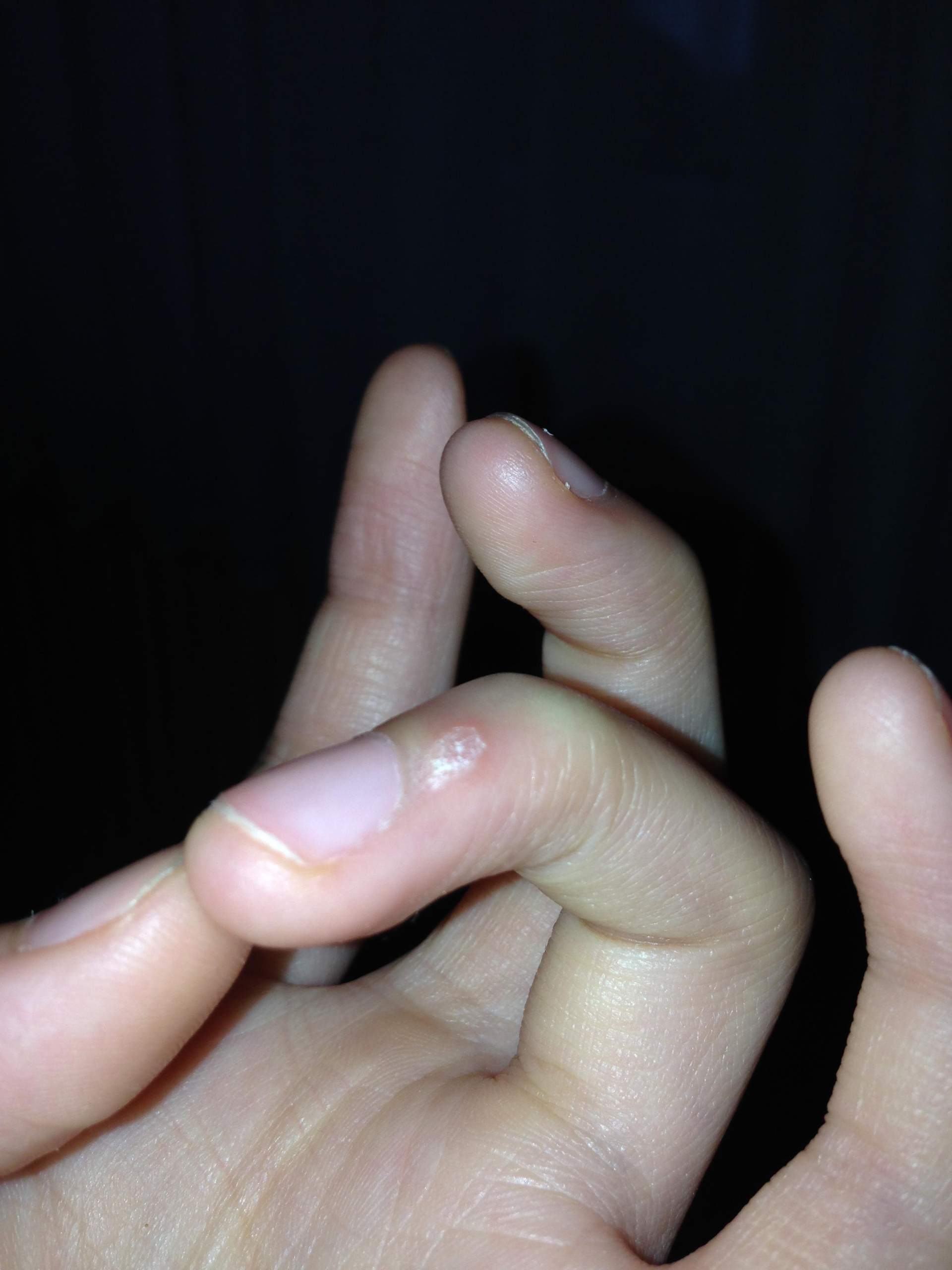 Kann mir jemand bitte sagen was das ist? (Finger, Ding)