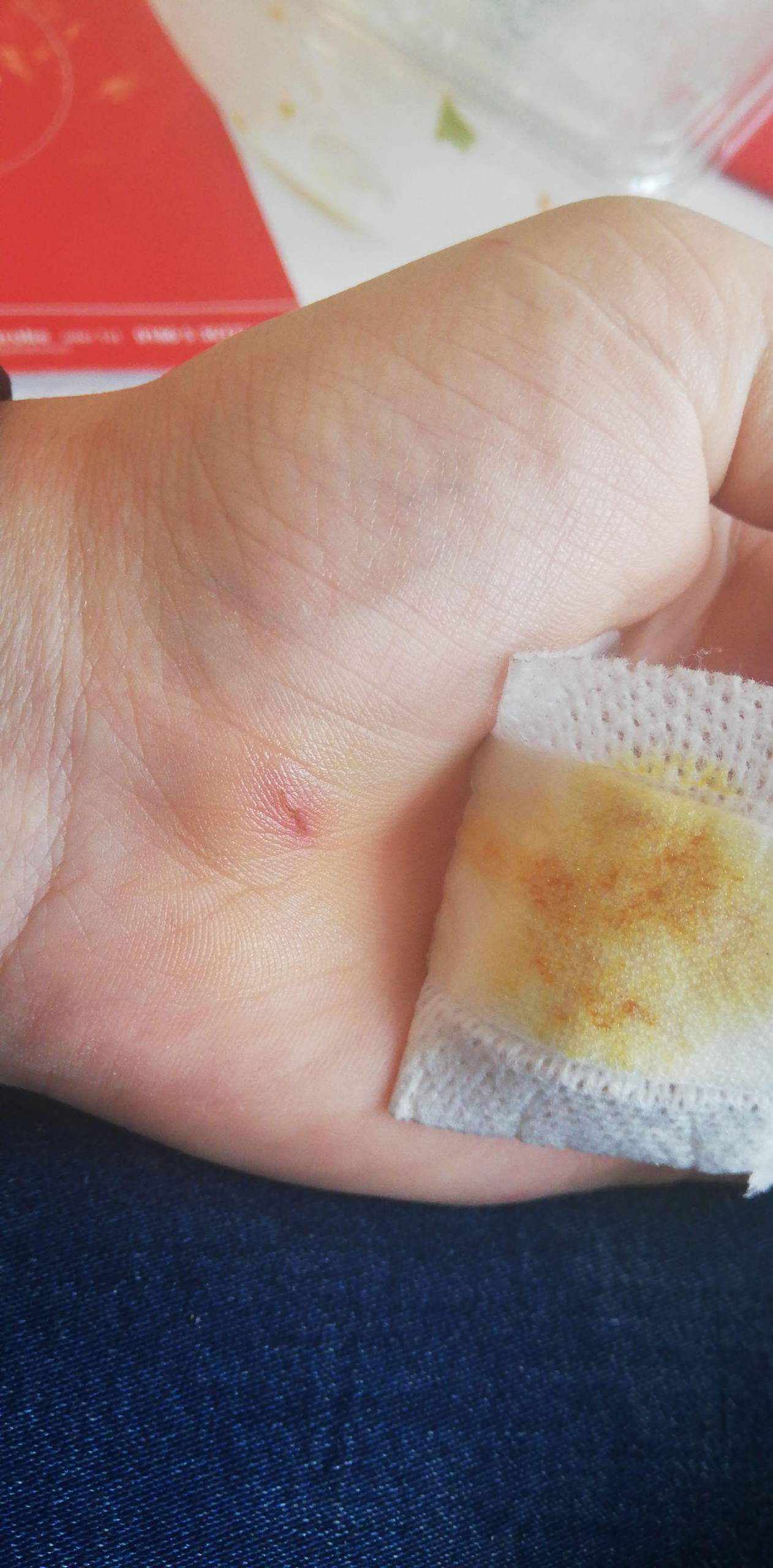 Katzenbiss verändert? (Gesundheit und Medizin, Gesundheit, Tiere)