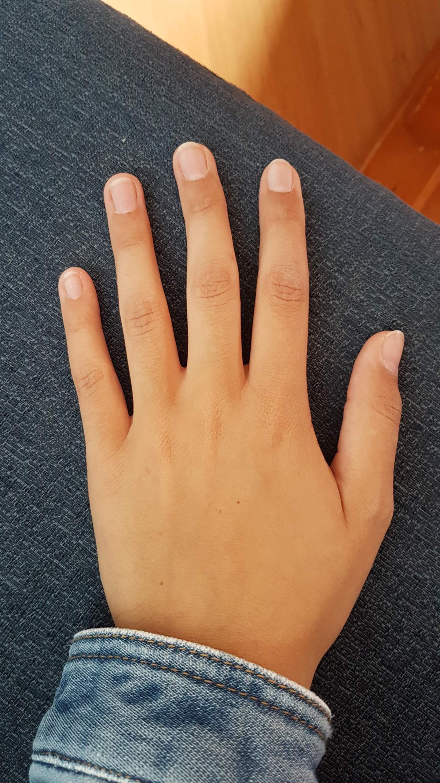 Krumme Mittelfinger? (Hand, Finger)