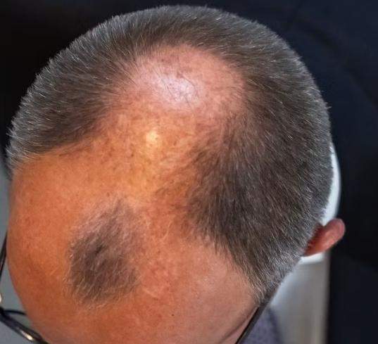 Lebt Friedrich Merz auch über seine Verhältnisse, wenn er bei seiner ...