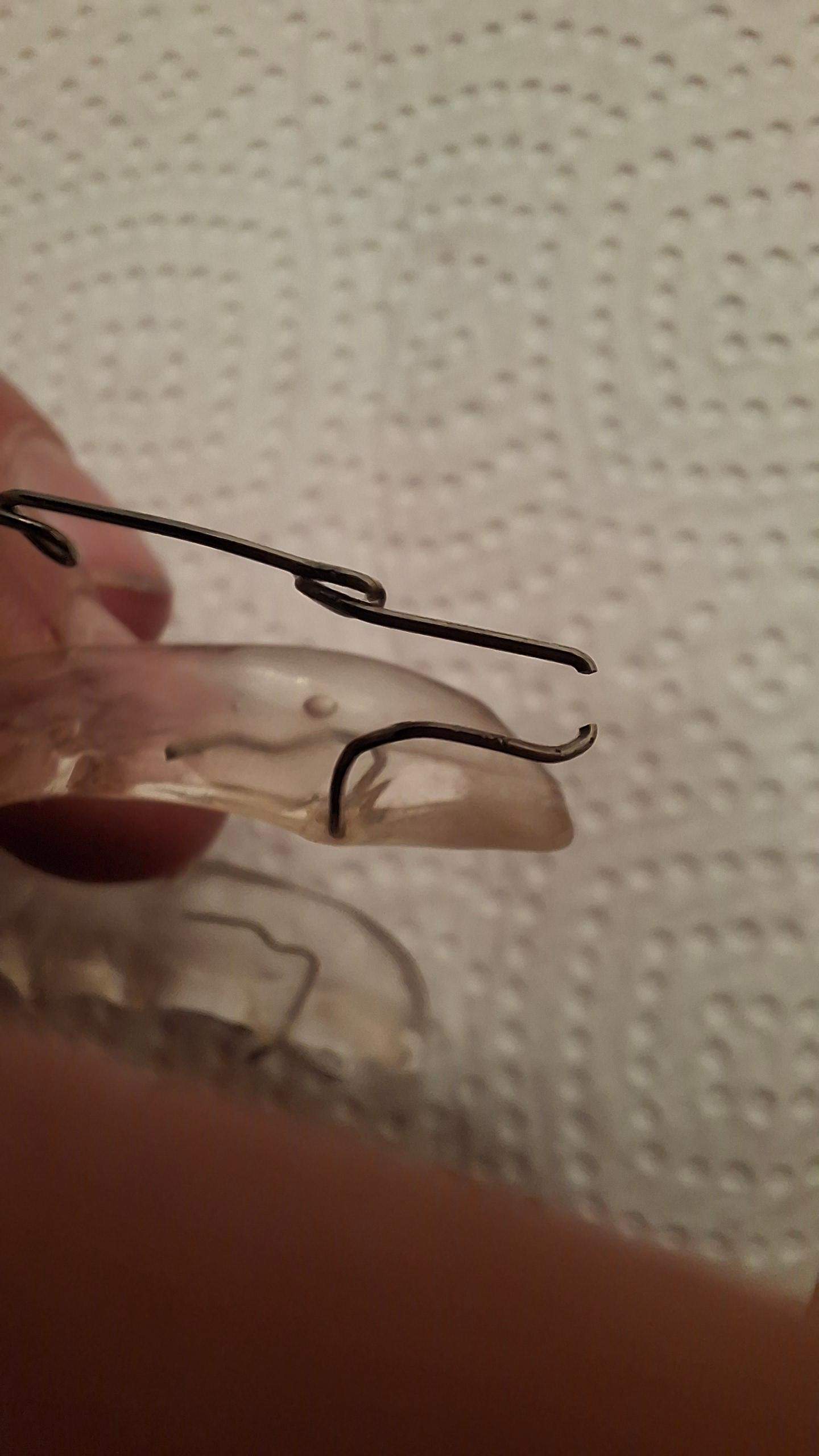 Loser Retainer defekt, reparierbar? (Zähne, Zahnspange, Zahnmedizin)