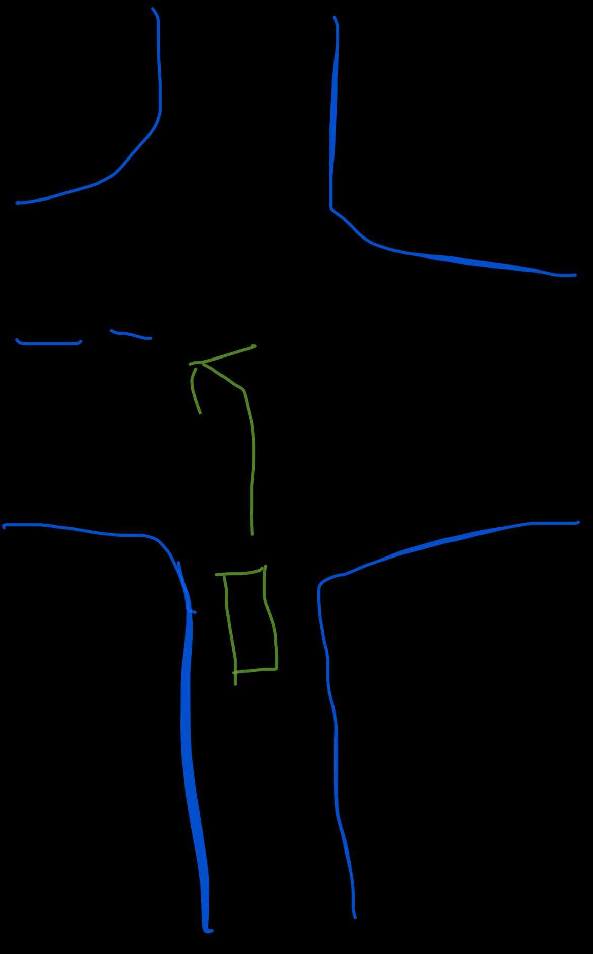 Mehrspuriges Abbiegen - In welche Spur einordnen? (Auto, Führerschein, Fahrschule)