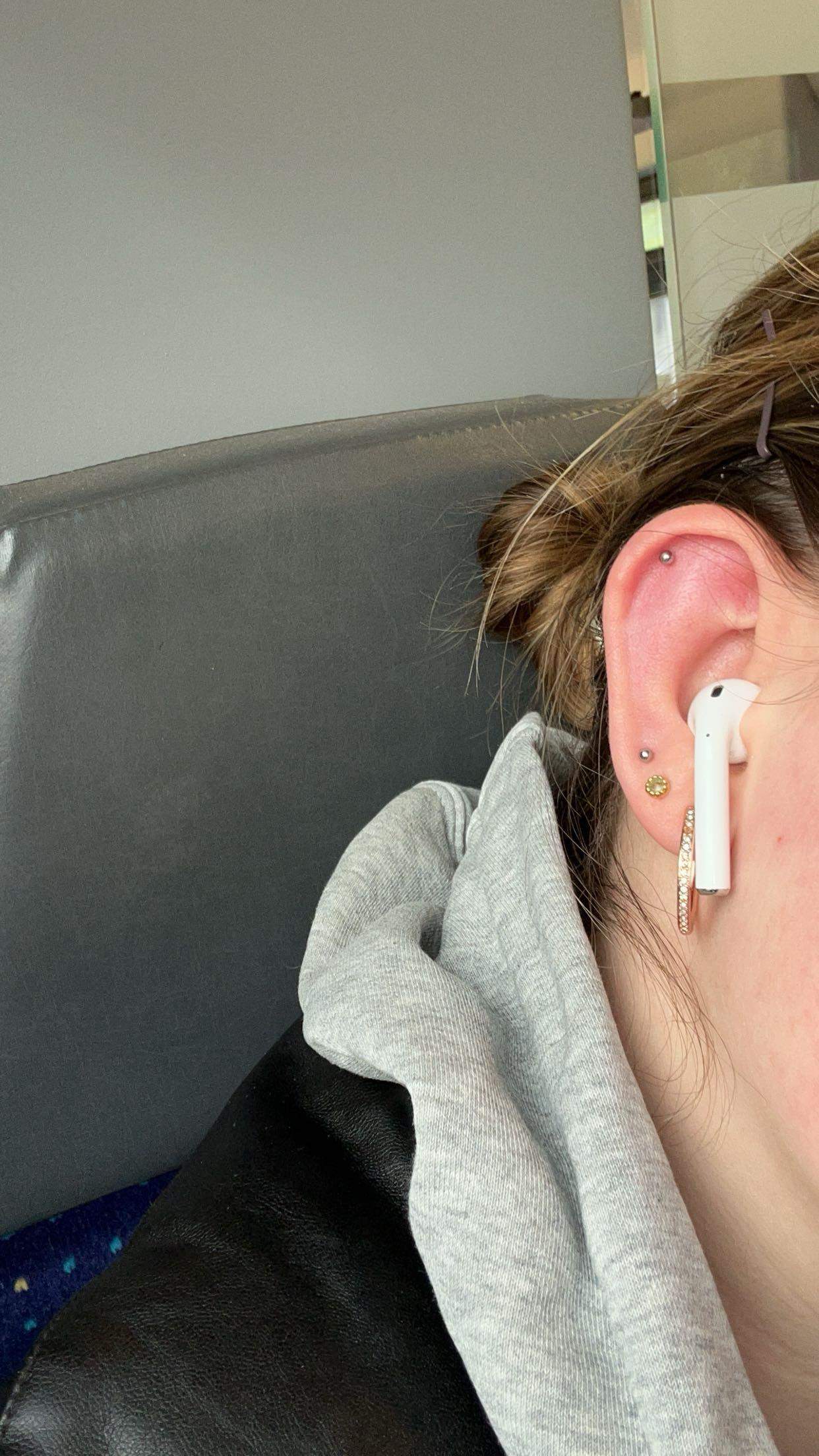 Mein helix ist angeschwollen was tun? (Schmerzen, Piercing)