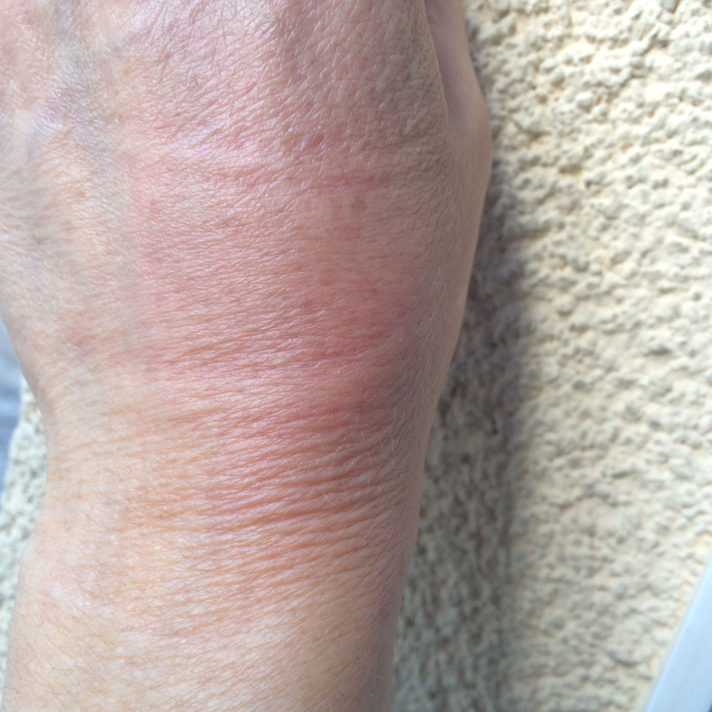 Meine Hand ist seit heute angeschwollen und tut weh. Was kann das sein ...