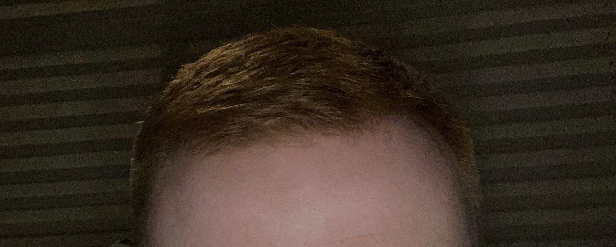 Meint ihr Boxerschnitt steht mir? (Jungs, Männer, Körper)