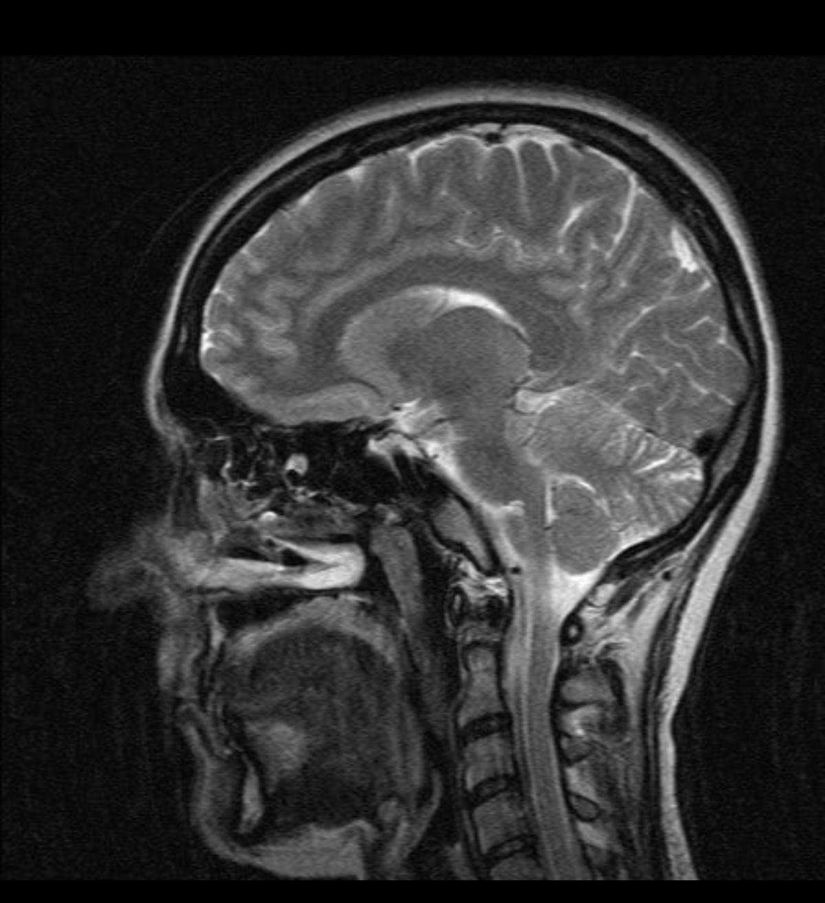 Mrt Bild bewerten? (Gesundheit und Medizin)