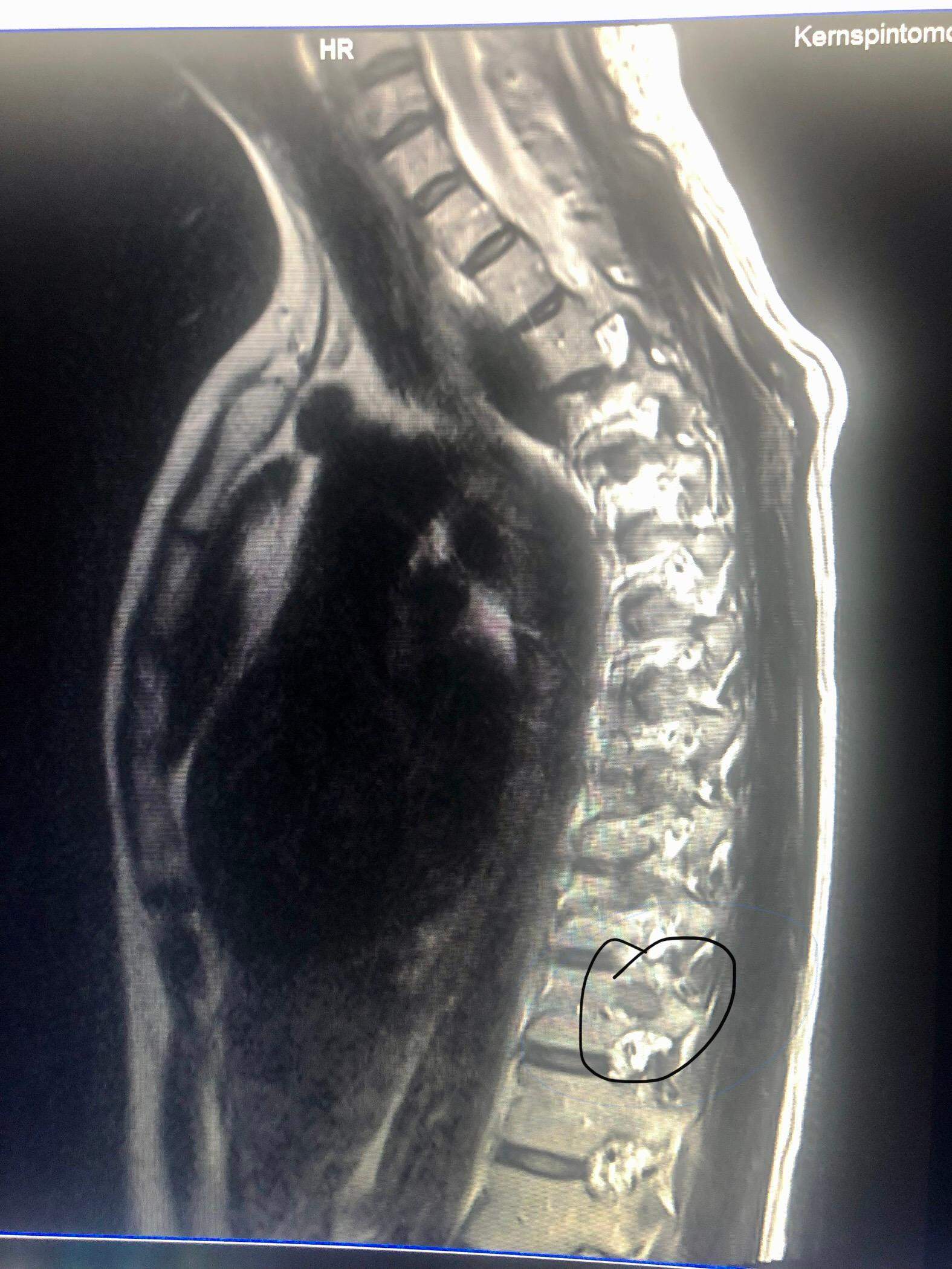 MRT BWS? (Computer, Gesundheit und Medizin, Ratgeber)