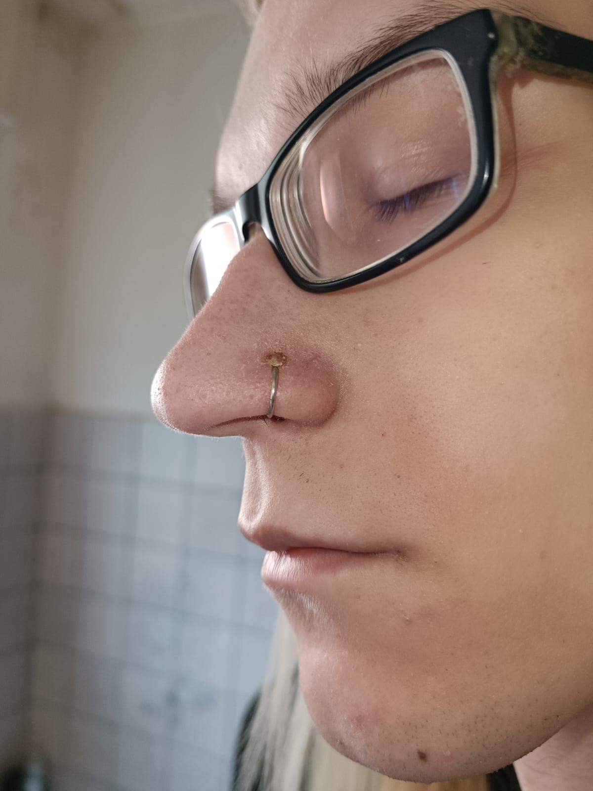 Nasenpiercing Entzundet Knubbel