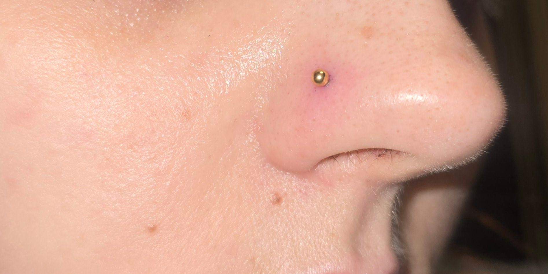 Nasenpiercing entzündet oder nur gereizt? (Schmerzen, Nase, Nostril ...