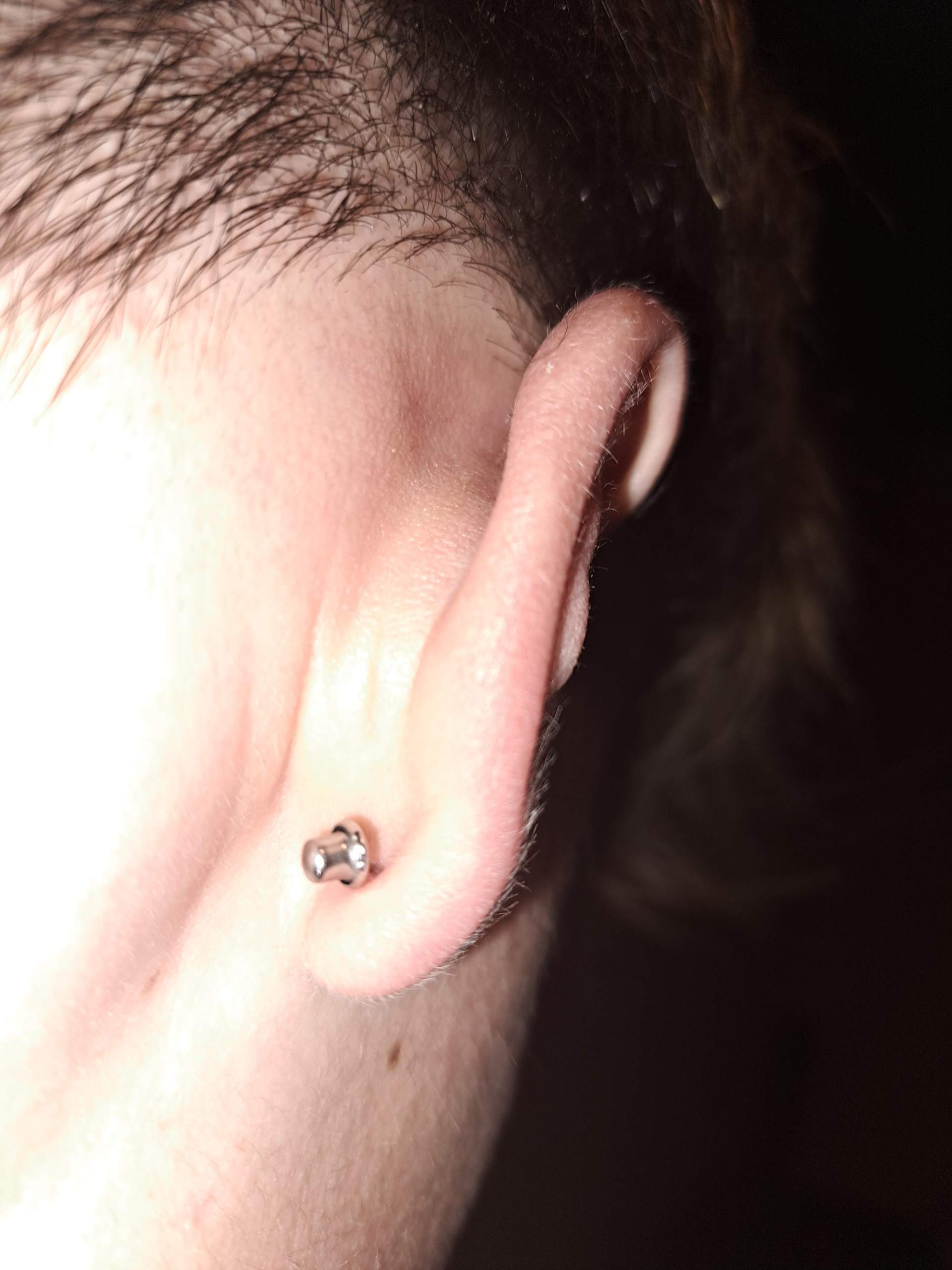 Ohring Gesundheis stecker ist hinten schief was tun? (Ohr, Ohrringe ...