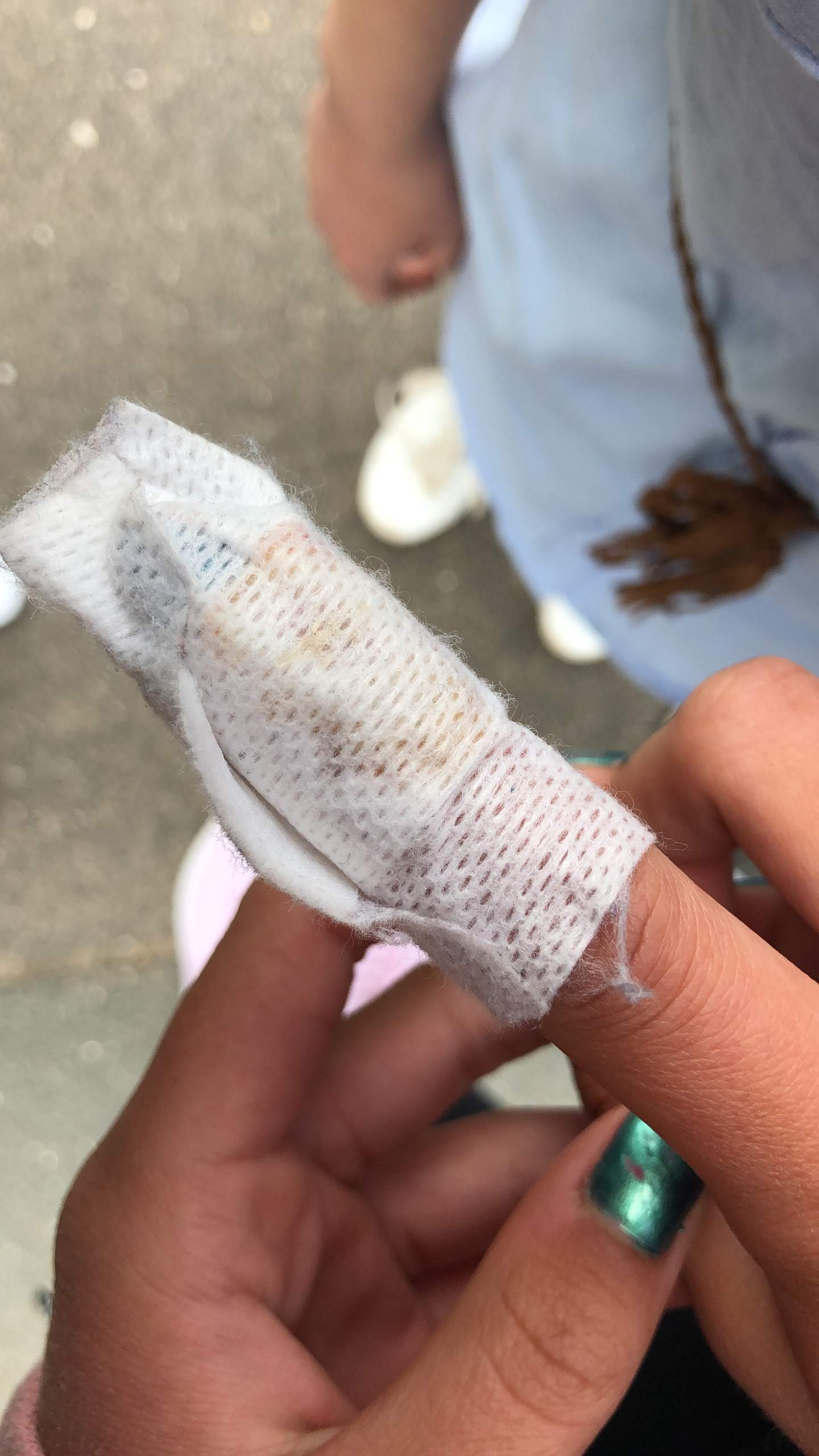 Pferde biss? (Gesundheit und Medizin, Gesundheit, Pferd)