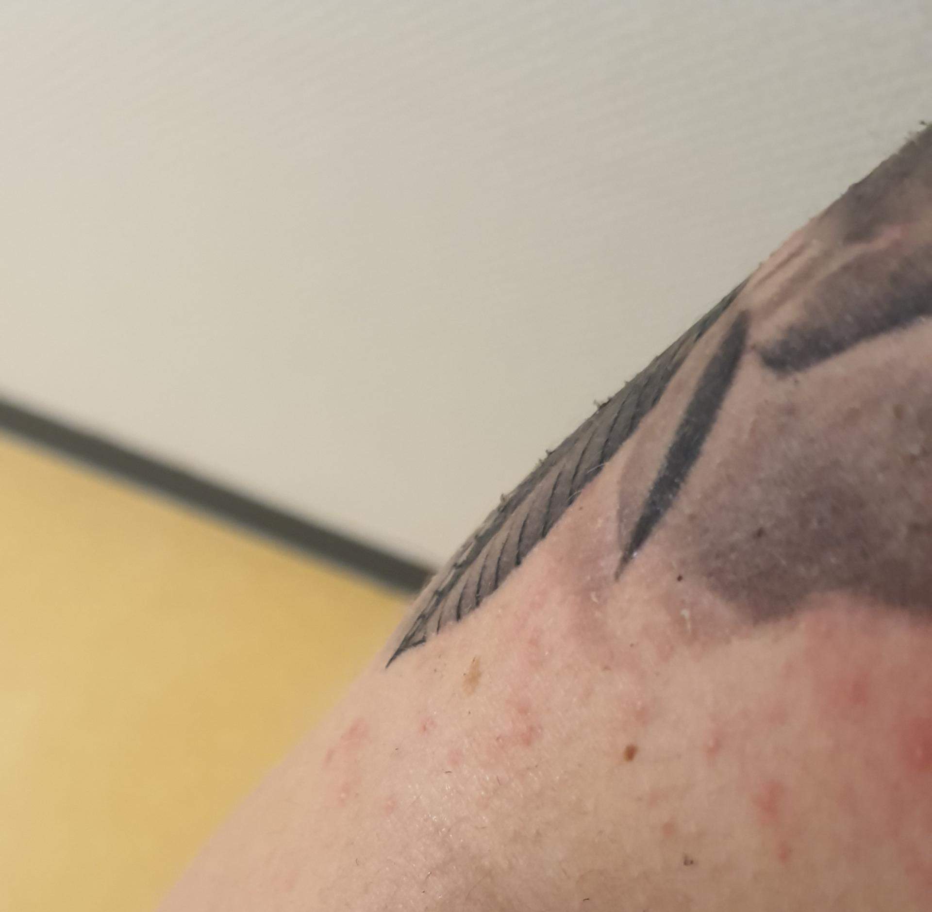 Pickel Unter Tattoo