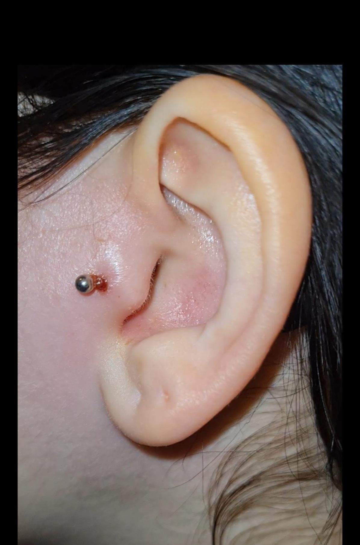 Piercing entzündet - zum Arzt? (Entzündung, Piercingpflege, Ohrknorpelpiercing)