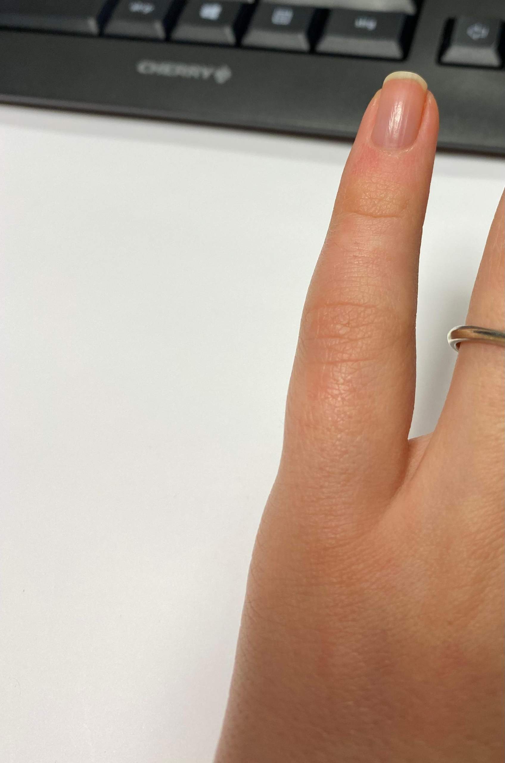 Prellung oder doch lieber zum Arzt? (Gesundheit und Medizin ...