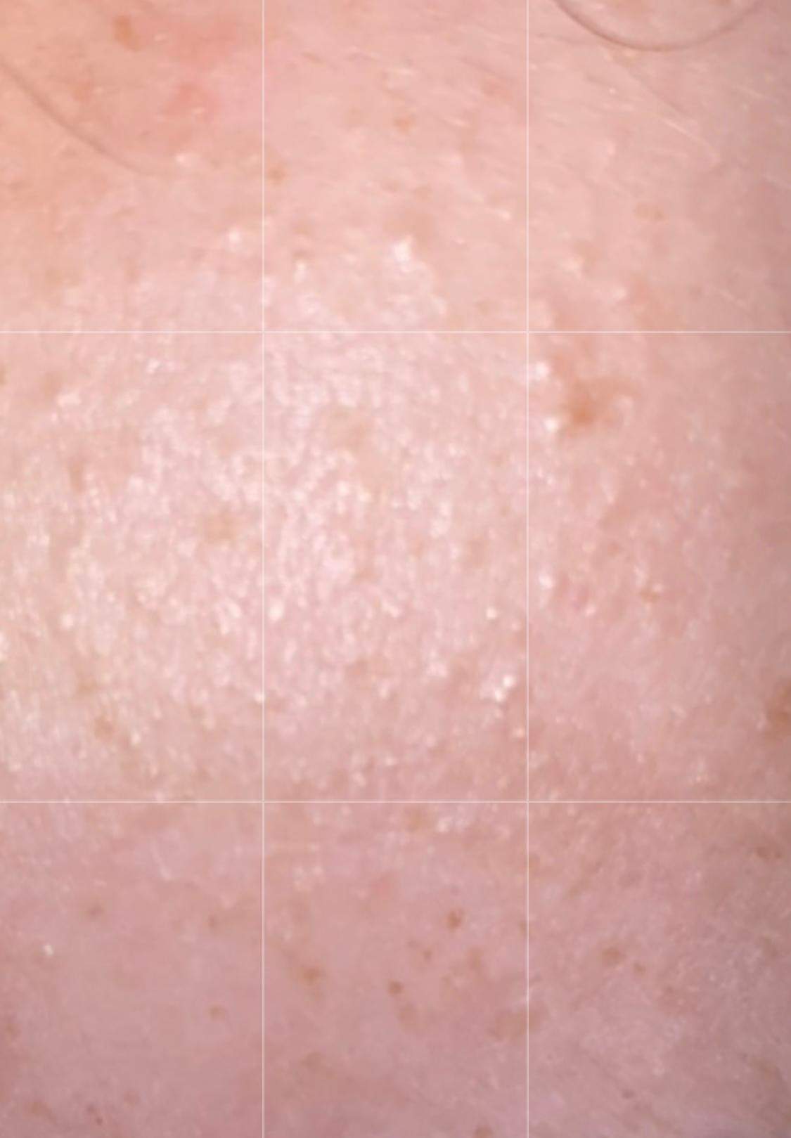 Punkte auf der Stirn? (Mädchen, Haut, Pflege)