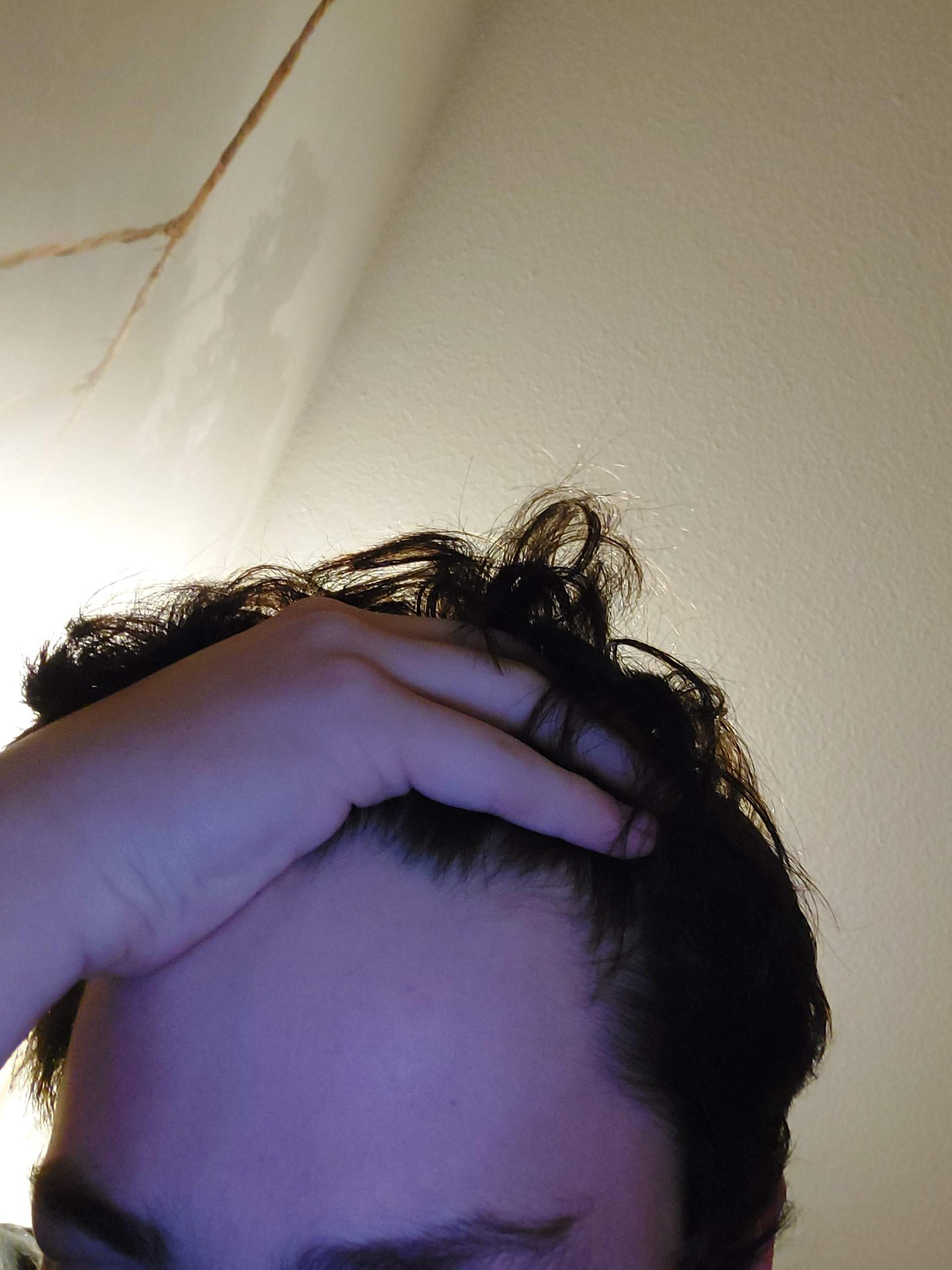 Riesen Stirn? (Männer, Aussehen, Style)