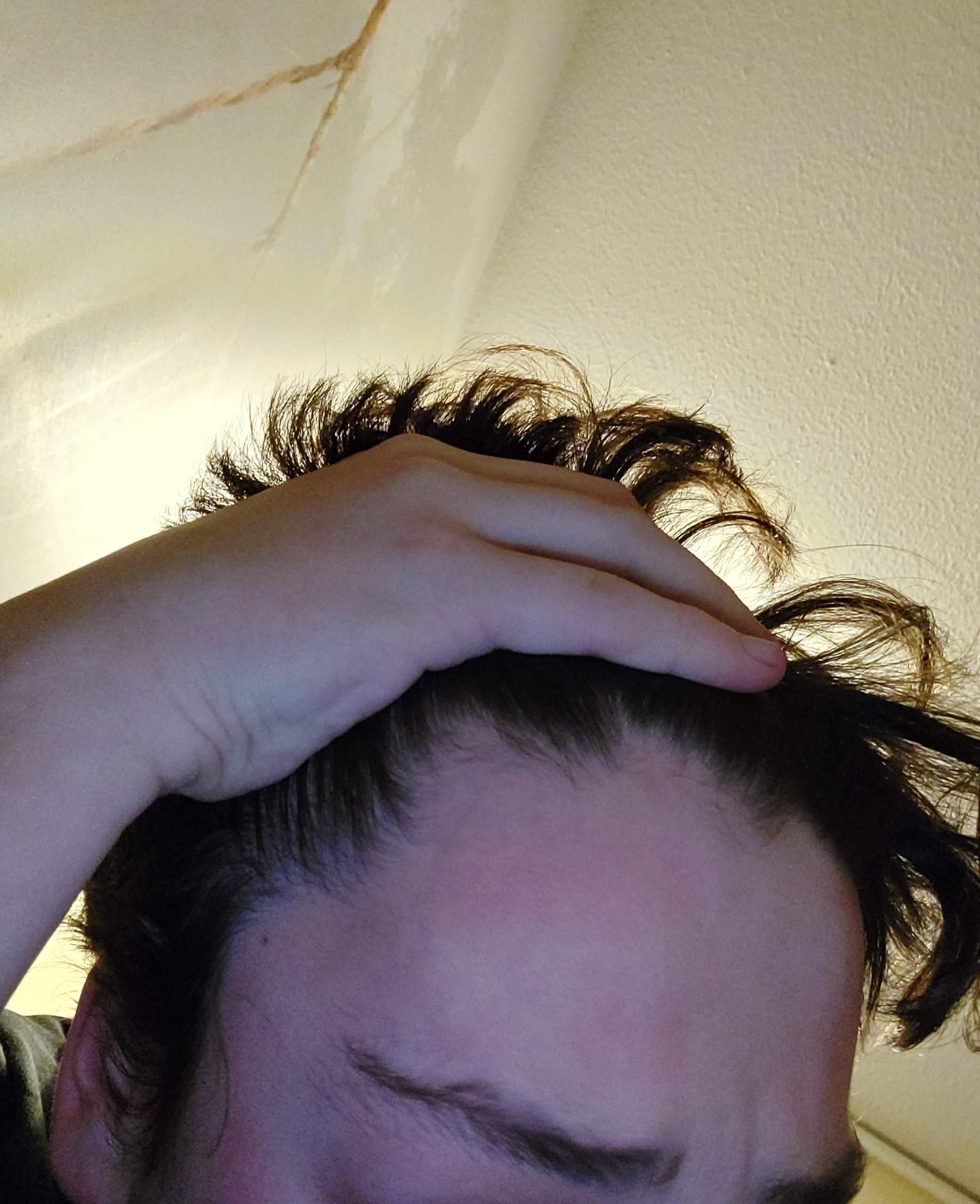 Riesen Stirn? (Männer, Aussehen, Style)