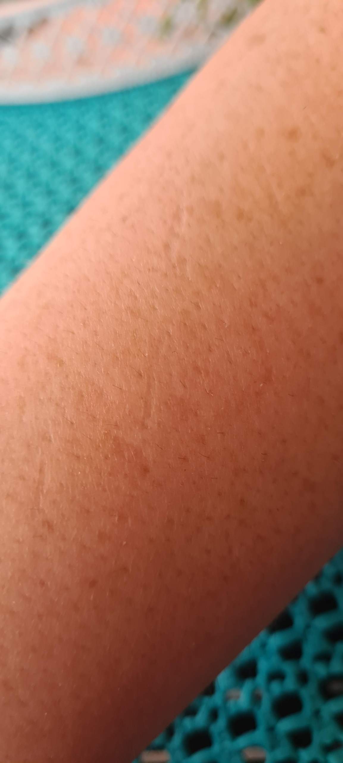 Risse in der Haut. Von was kommt das?