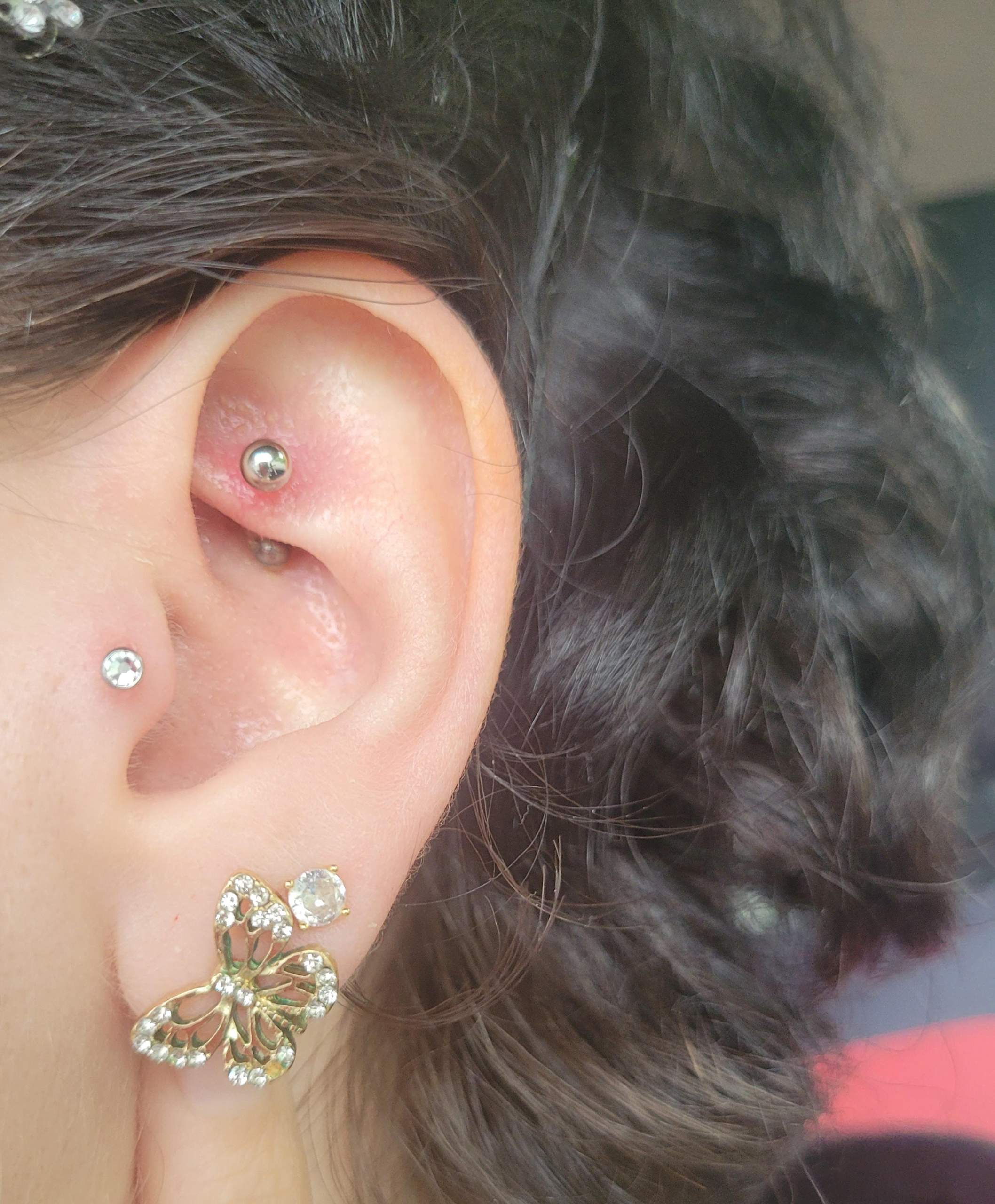 Rook und Tragus entzündet? (Schmerzen, Piercing, Entzündung)