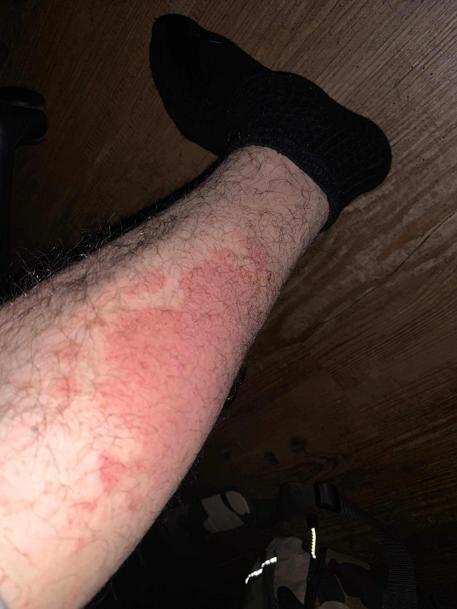 Roter Fleck? (Gesundheit und Medizin, Haut)