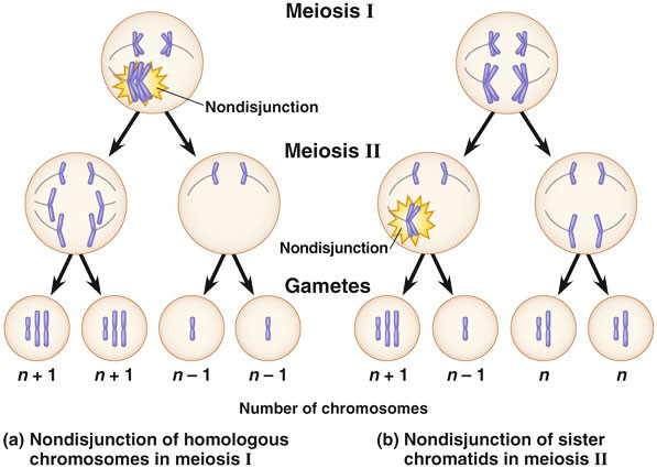 Schaubild zur Trisomie? (Biologie, Down-Syndrom)