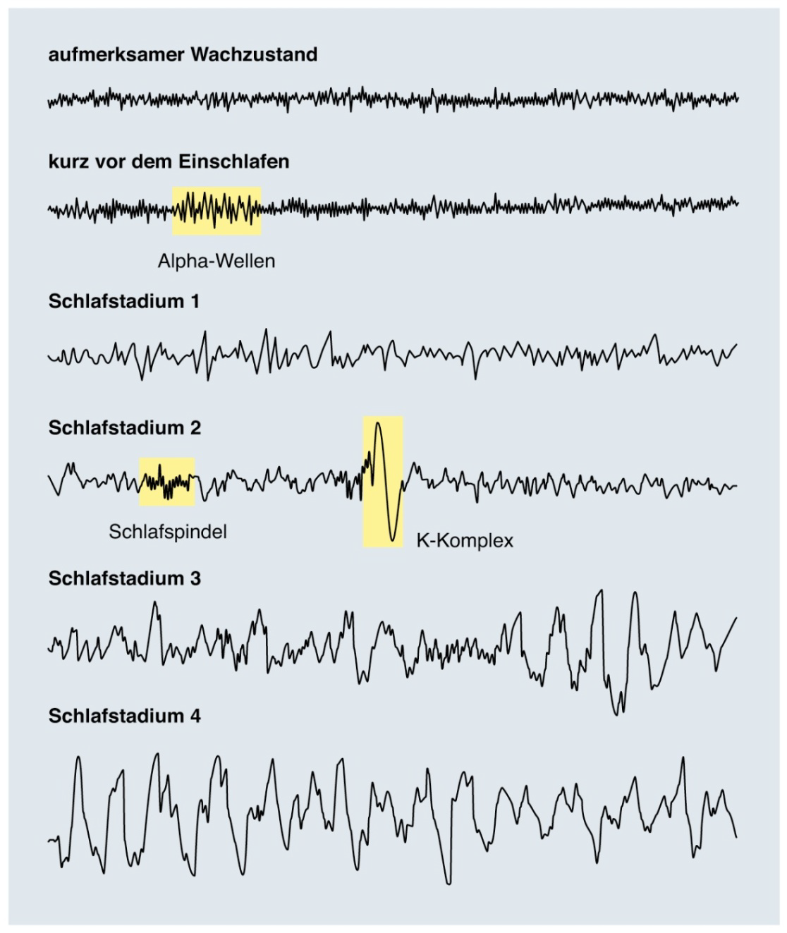 Schlafspindel, verschiede Schlafphasen und deren Wellenlängen ...