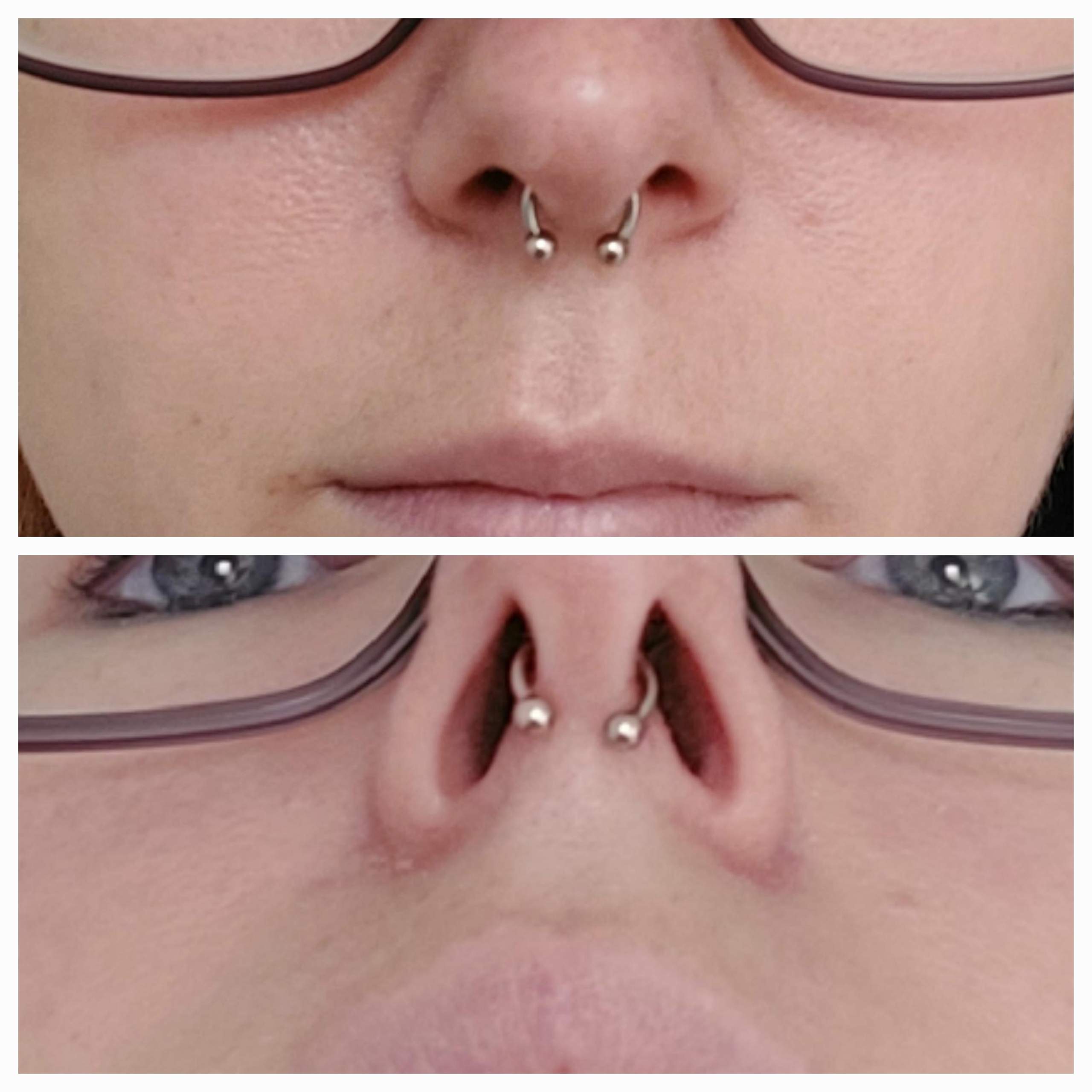 Septum Stechen Wo Genau