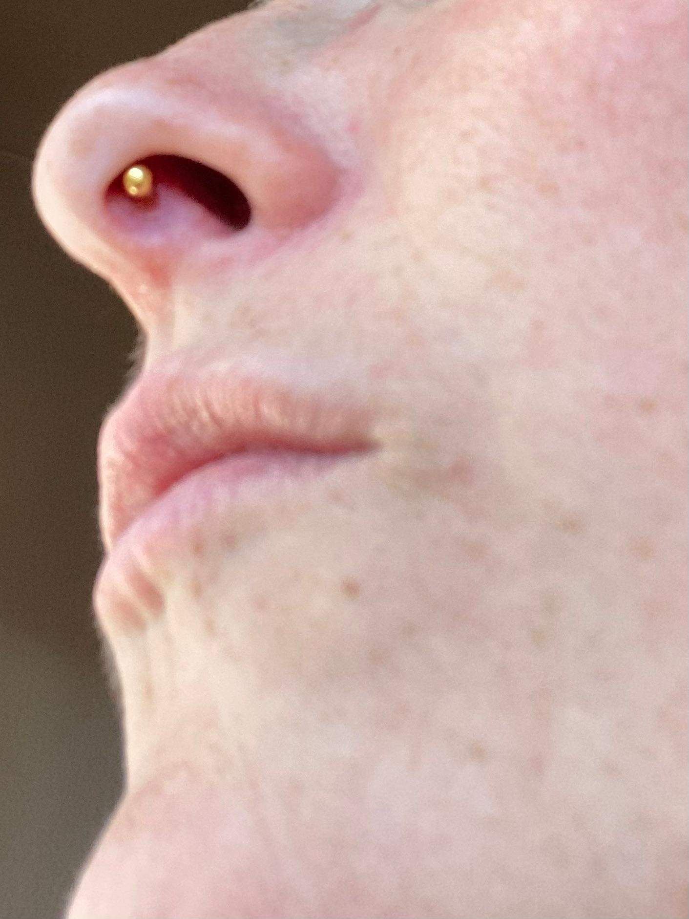 Septum Stechen Wo Genau