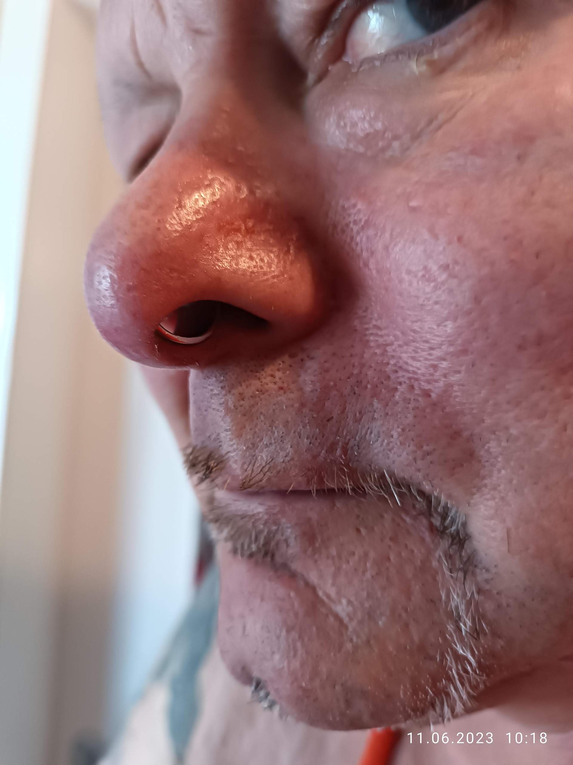 Septum zu groß, 16mm? (Piercing, Nase, Nasenpiercing)