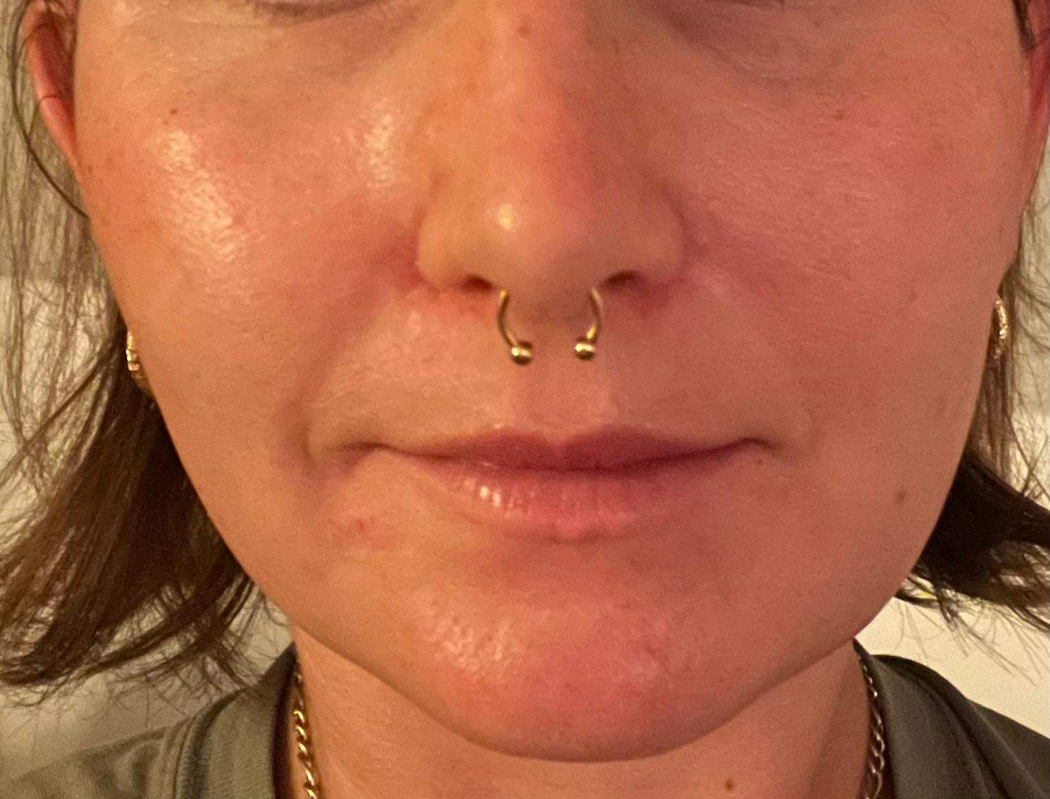 Septumring zu groß und richtig gestochen? (Aussehen, Piercing ...