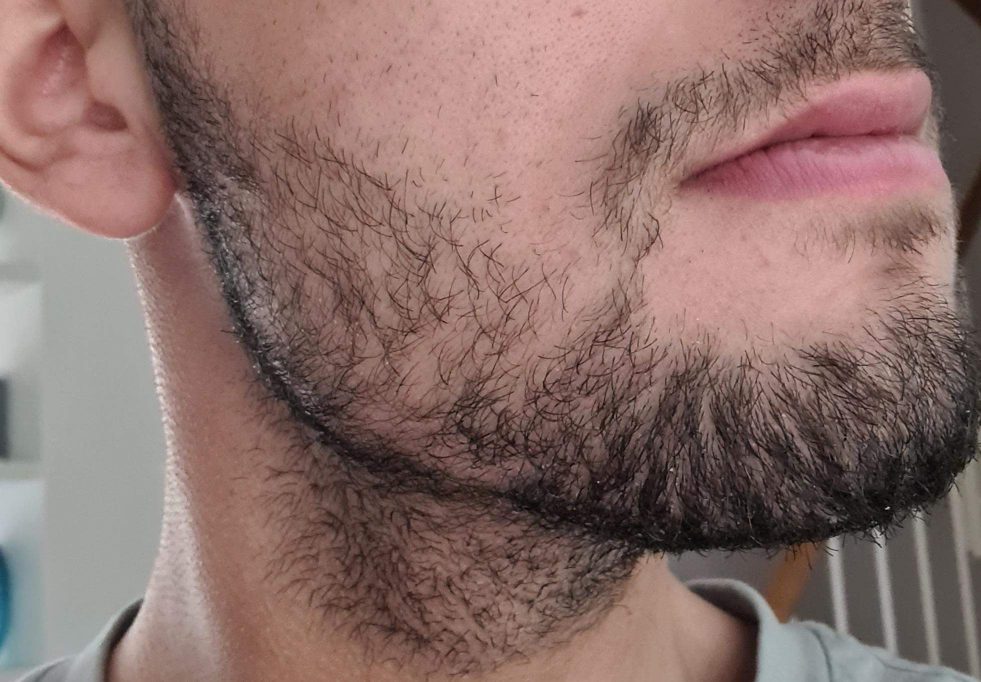 Sieht der Bart gut aus, wenn ich die Konturen schneide oder sollte ich ...