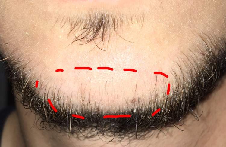 Sind das barthaare? (Bart, Wuchs)